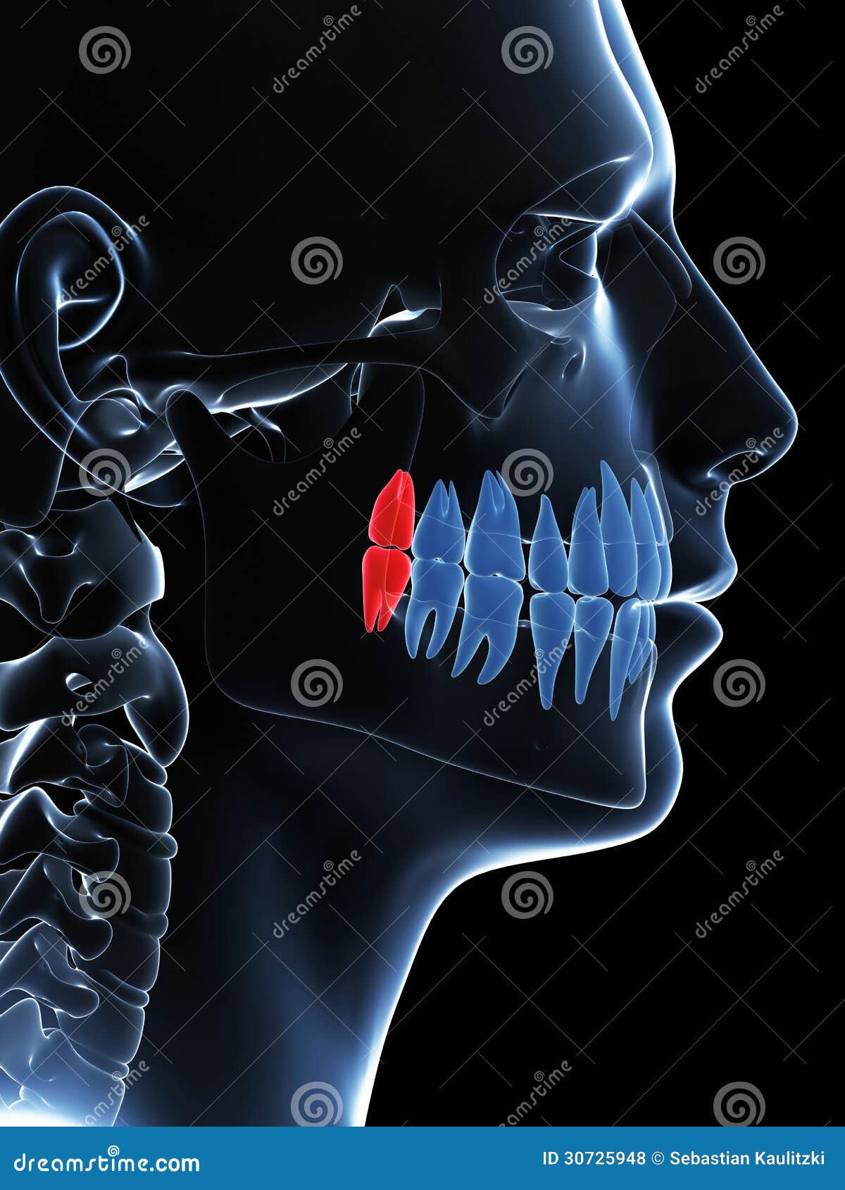 Wisdom teeth stock illustration. Illustration of blue - 30725948