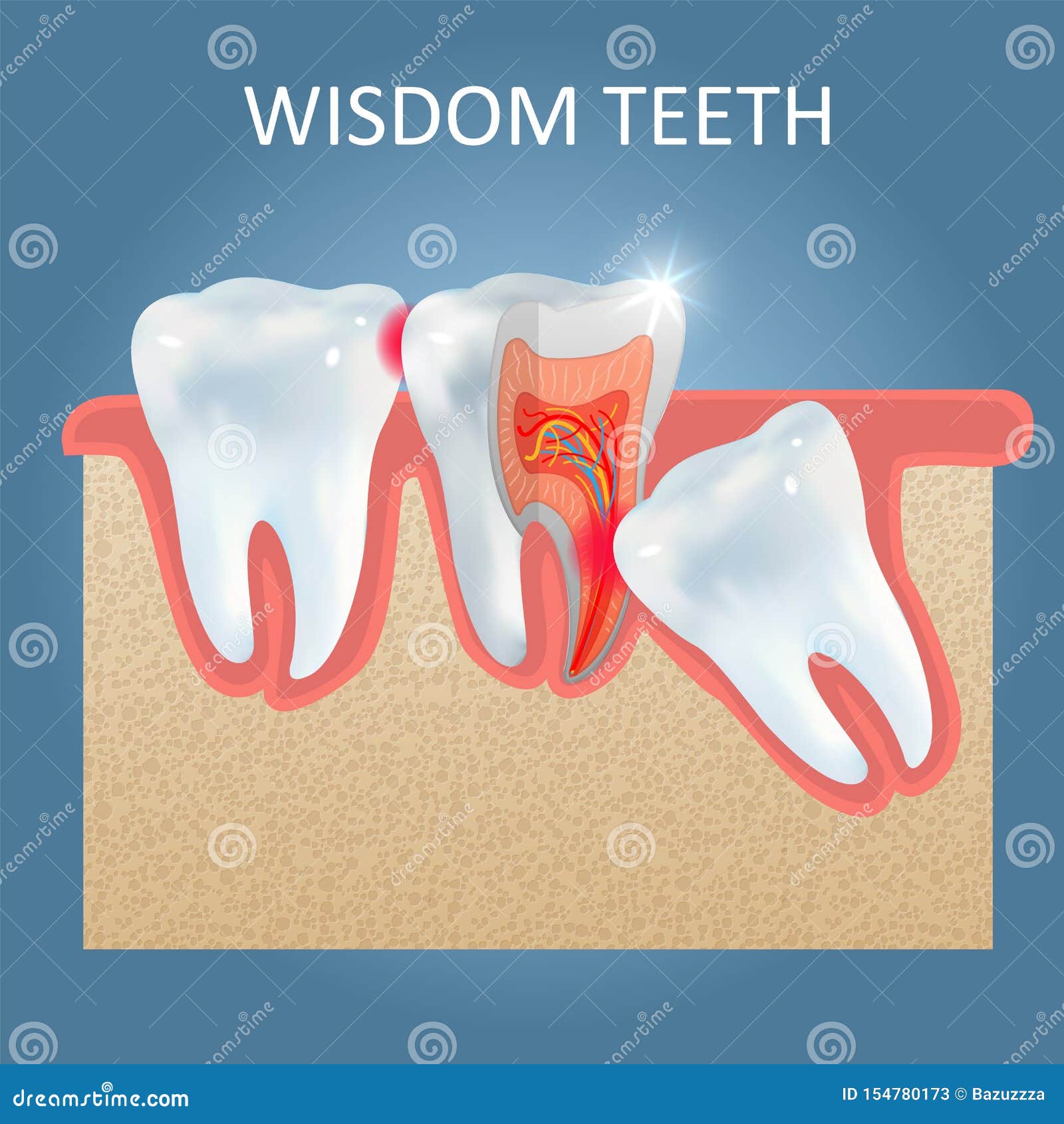 Wisdom Teeth Problems Vector Poster Design Template Stock Vector ...