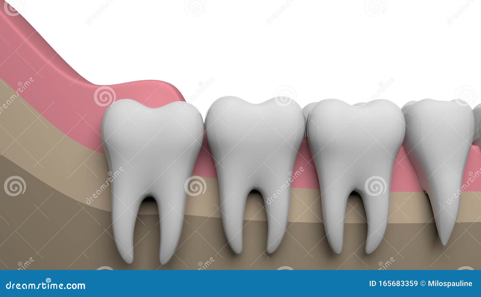 Wisdom Tooth, 3D-rendering, White Background Stock Illustration ...