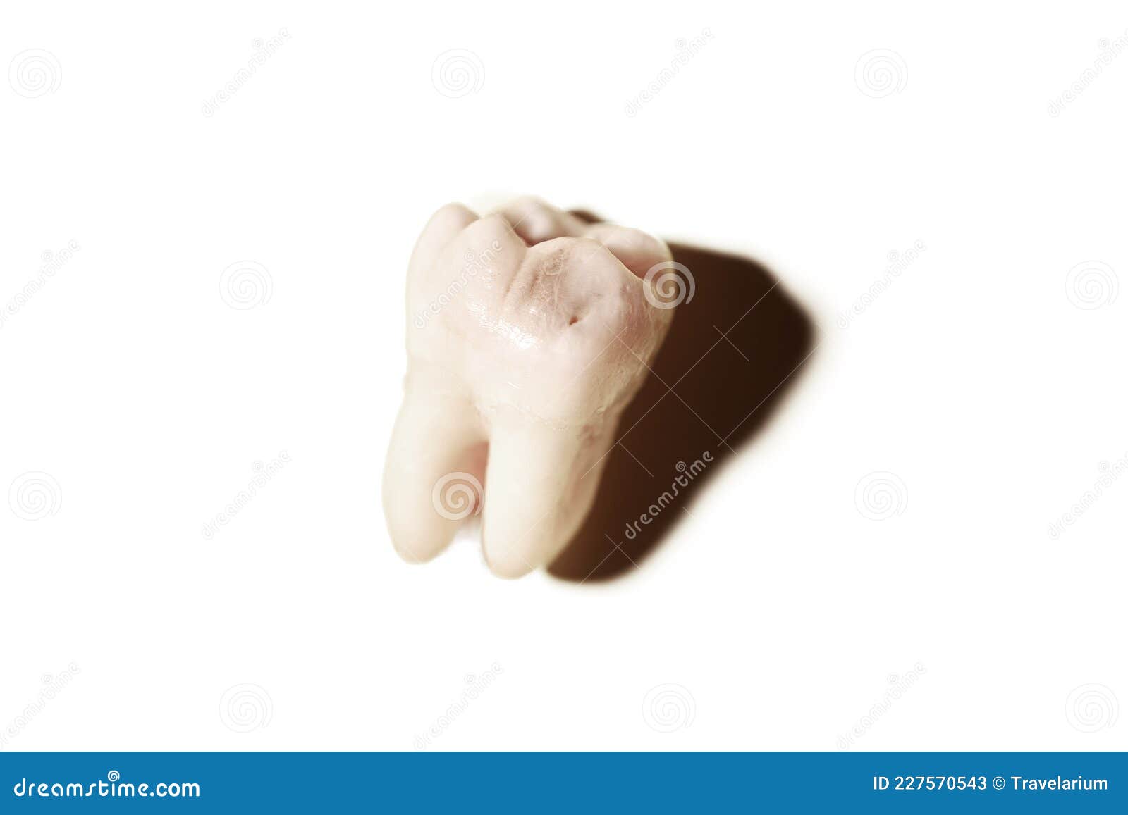 Wisdom Tooth with Tooth Decay, Isolated White Background Stock Image ...