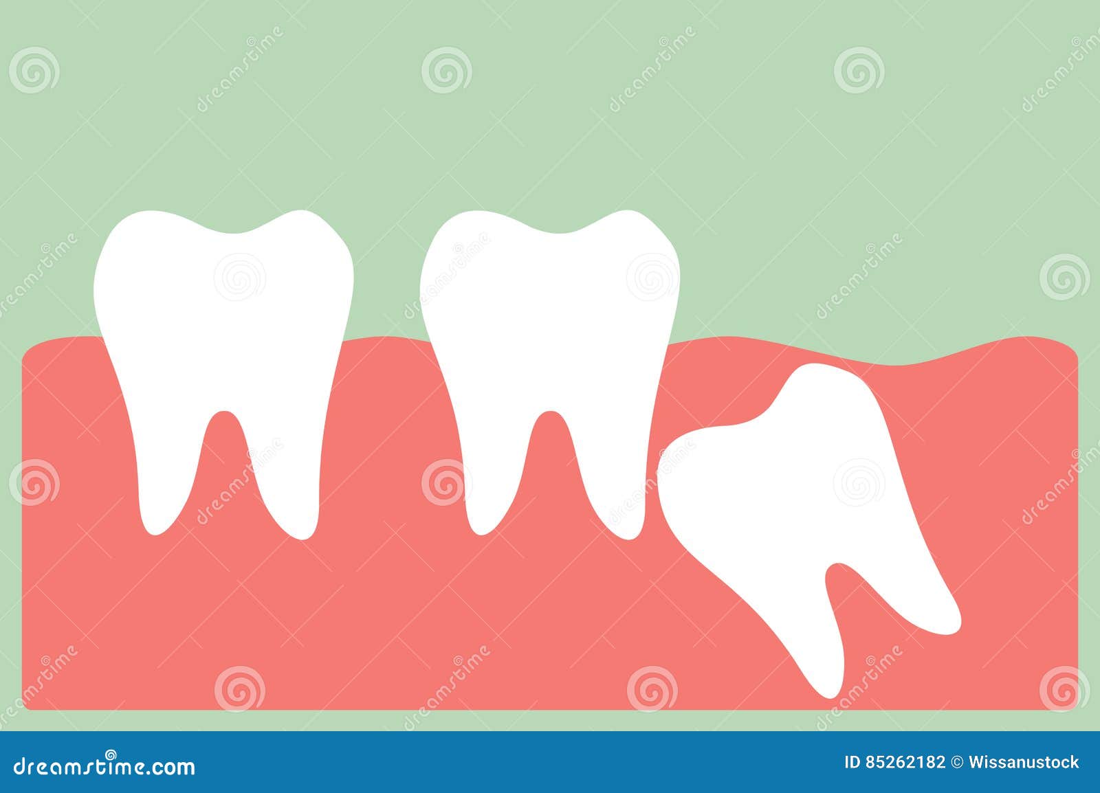 Wisdom Tooth Poster Cartoon Vector | CartoonDealer.com #226692465