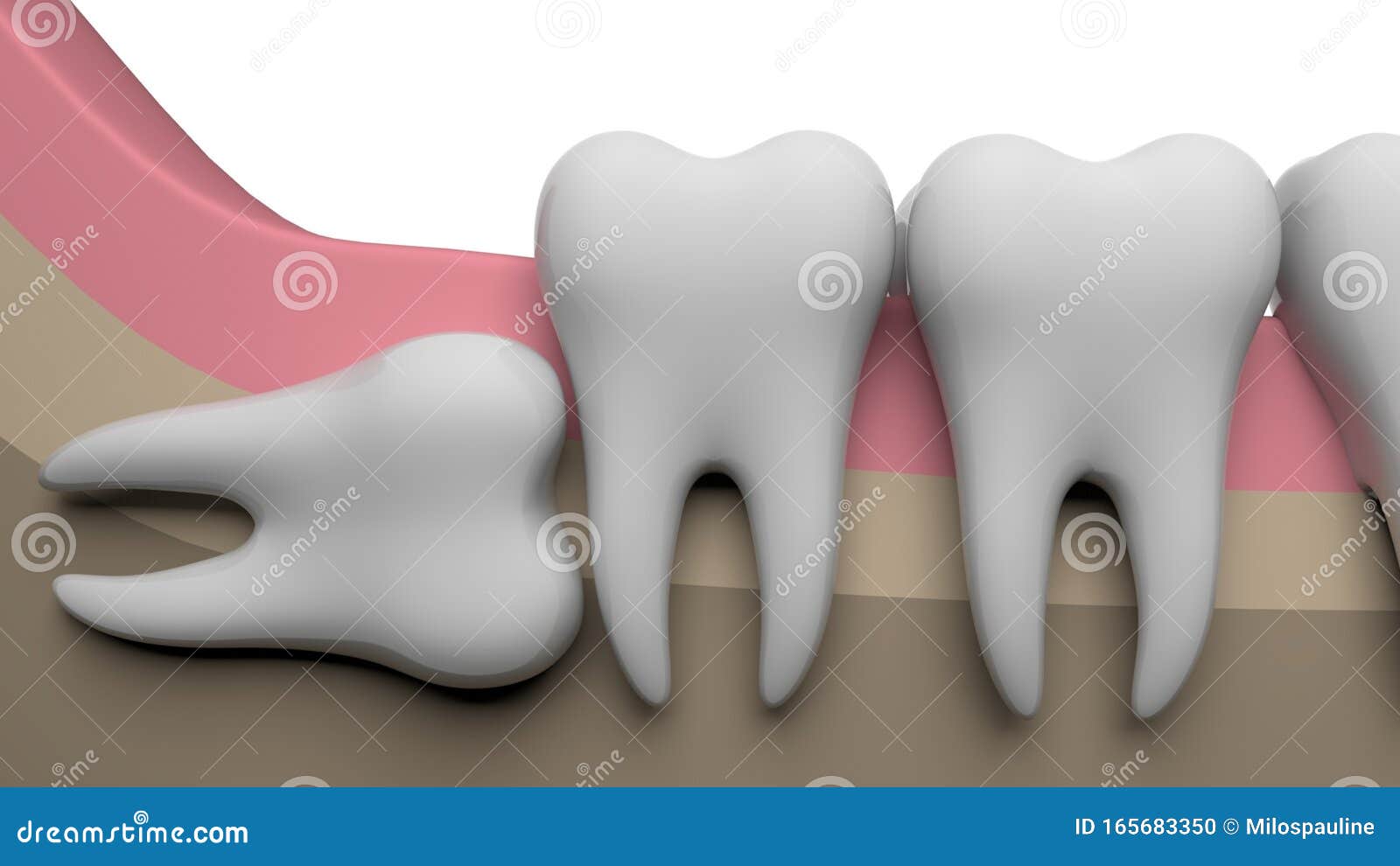 Wisdom Tooth Horizontal, 3D-rendering, White Background Stock ...