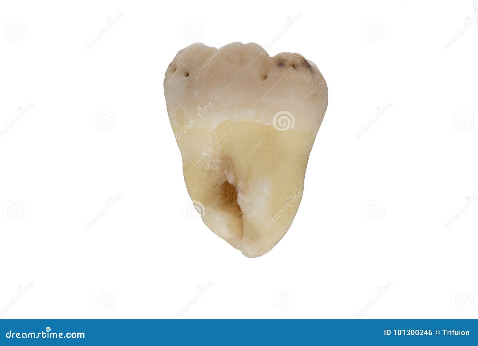 Wisdom Tooth on White Background Stock Photo - Image of clean ...