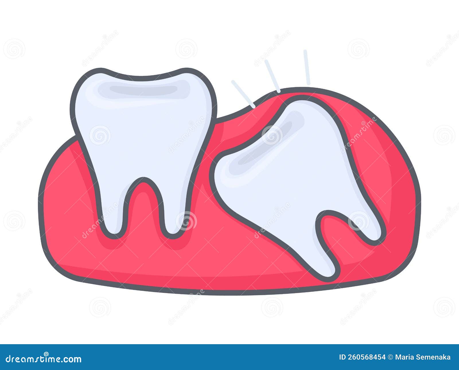 Wisdom Tooth Pushing Another Tooth, Teeth and Dentistry Tooth Concept ...