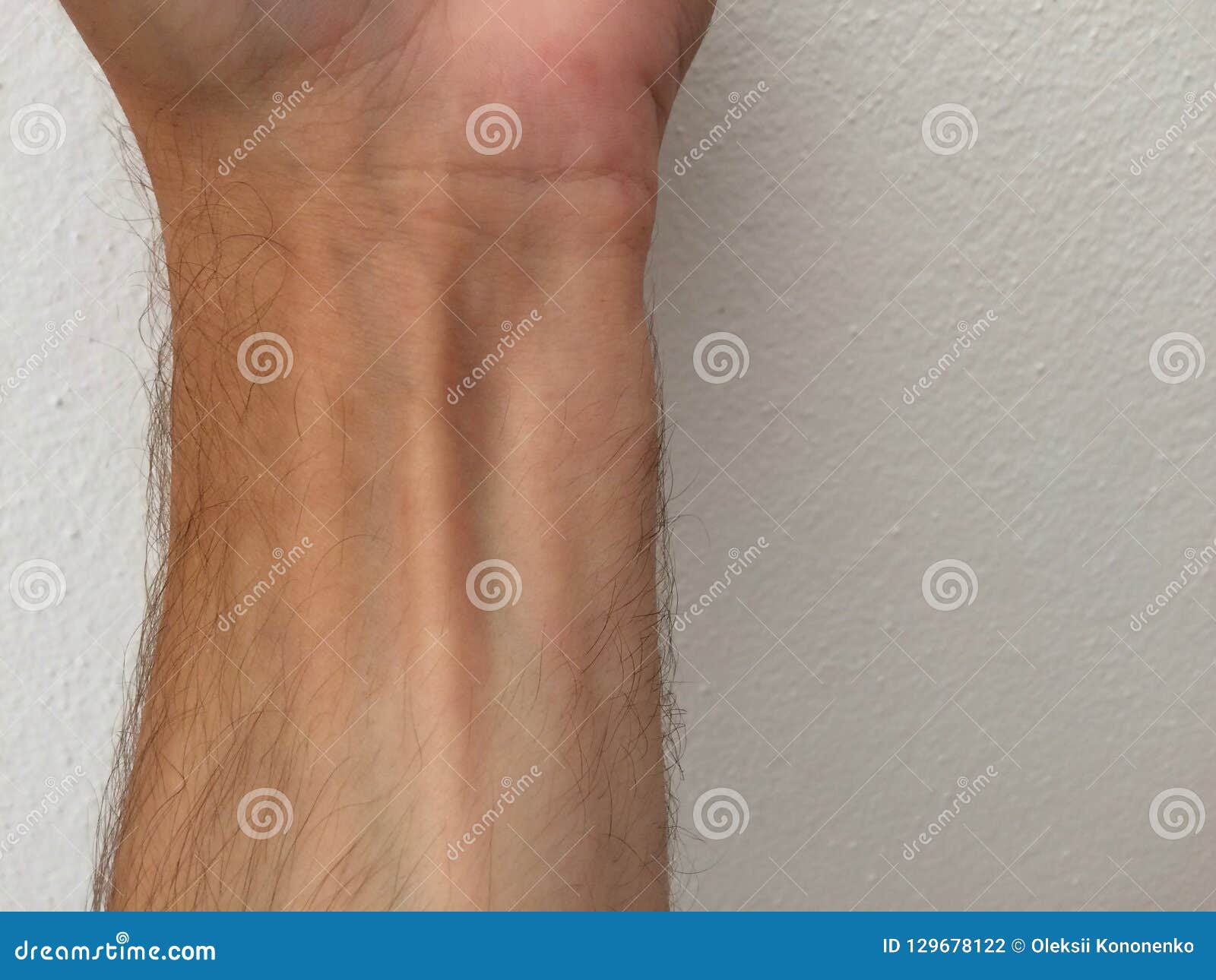 Witte Mannelijke Pols En Aders Stock Foto - Image of aders, lichaam ...