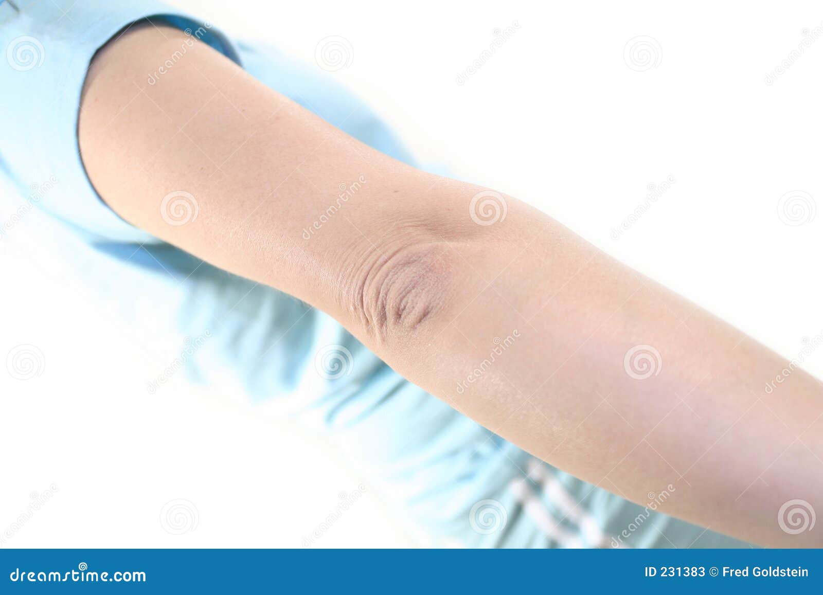 Woman arm stock image. Image of skin, body, protection - 231383