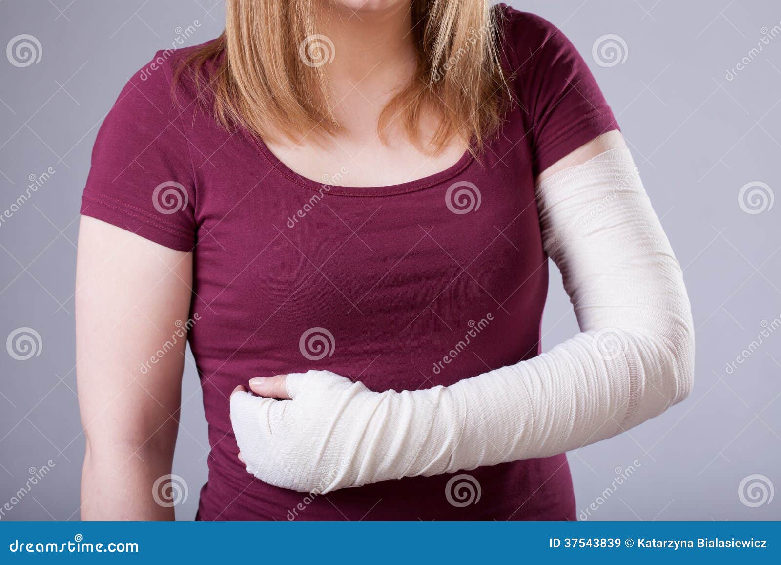 Woman with bandaged arm stock image. Image of broken - 37543839