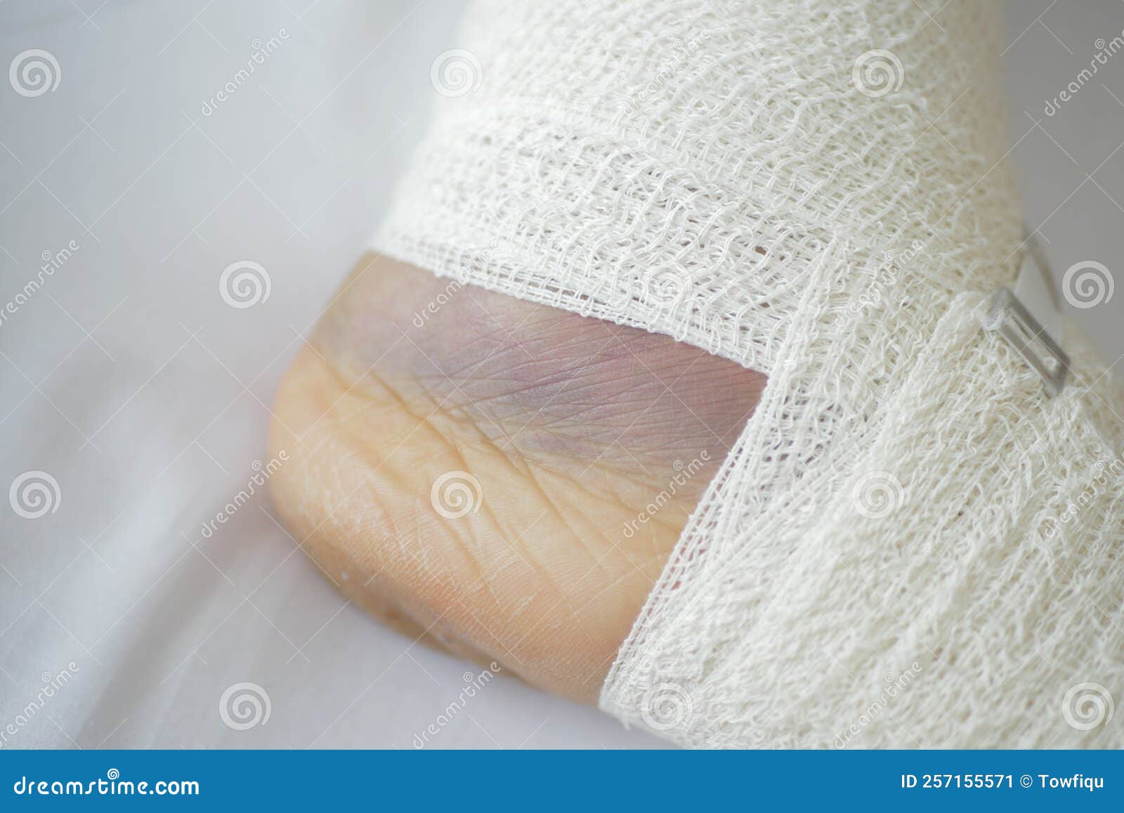 Woman with Bandaged Foot on Bed Stock Image - Image of recovery ...