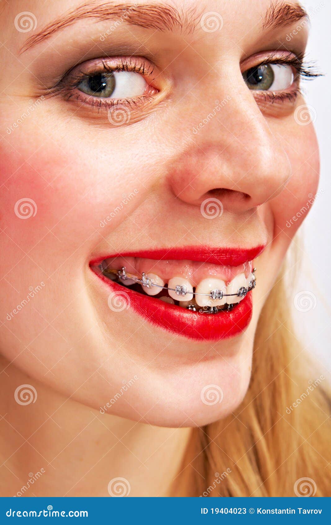 Woman with brackets stock image. Image of happiness, dentist - 19404023