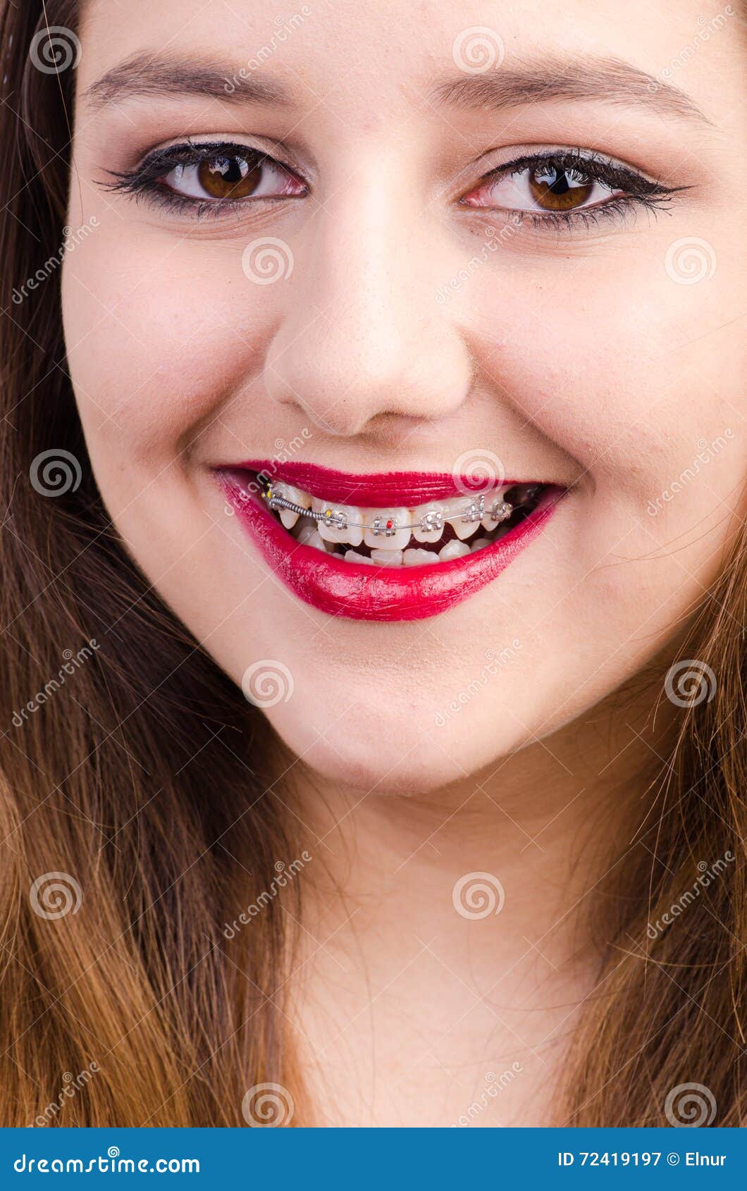 The Woman with Brackets Isolated on White Stock Image - Image of face ...