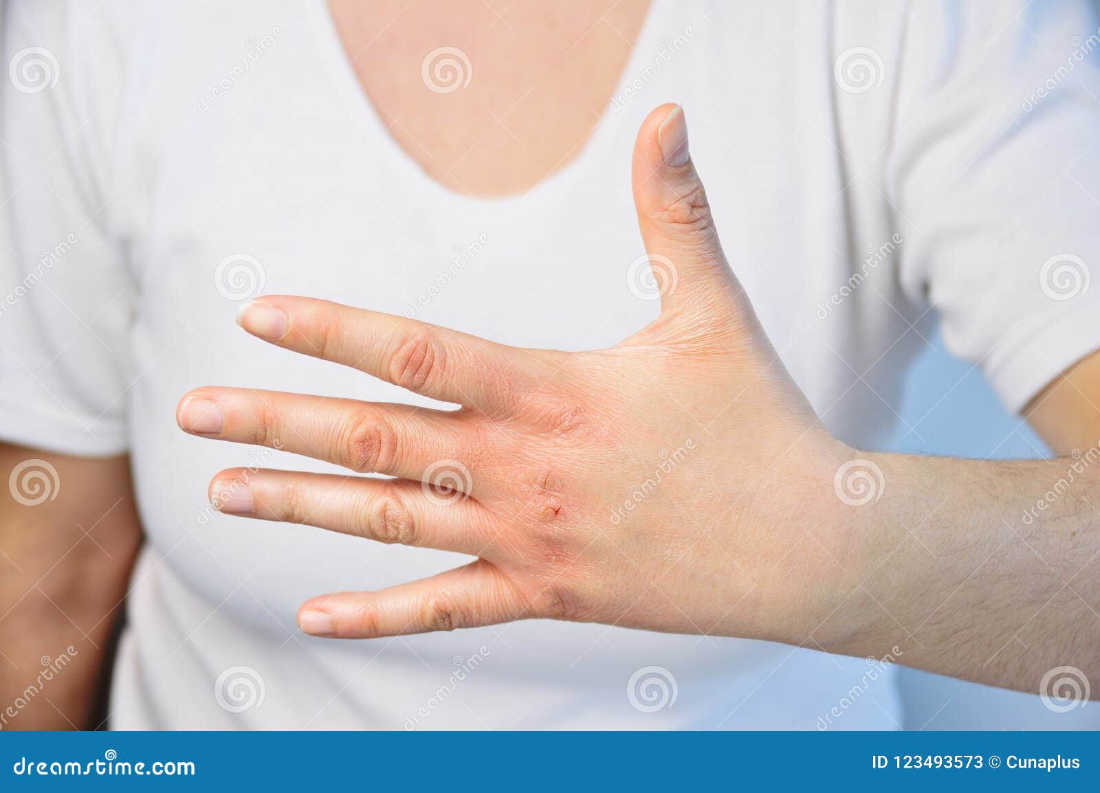 Checking the hand stock image. Image of female, chapped - 123493573