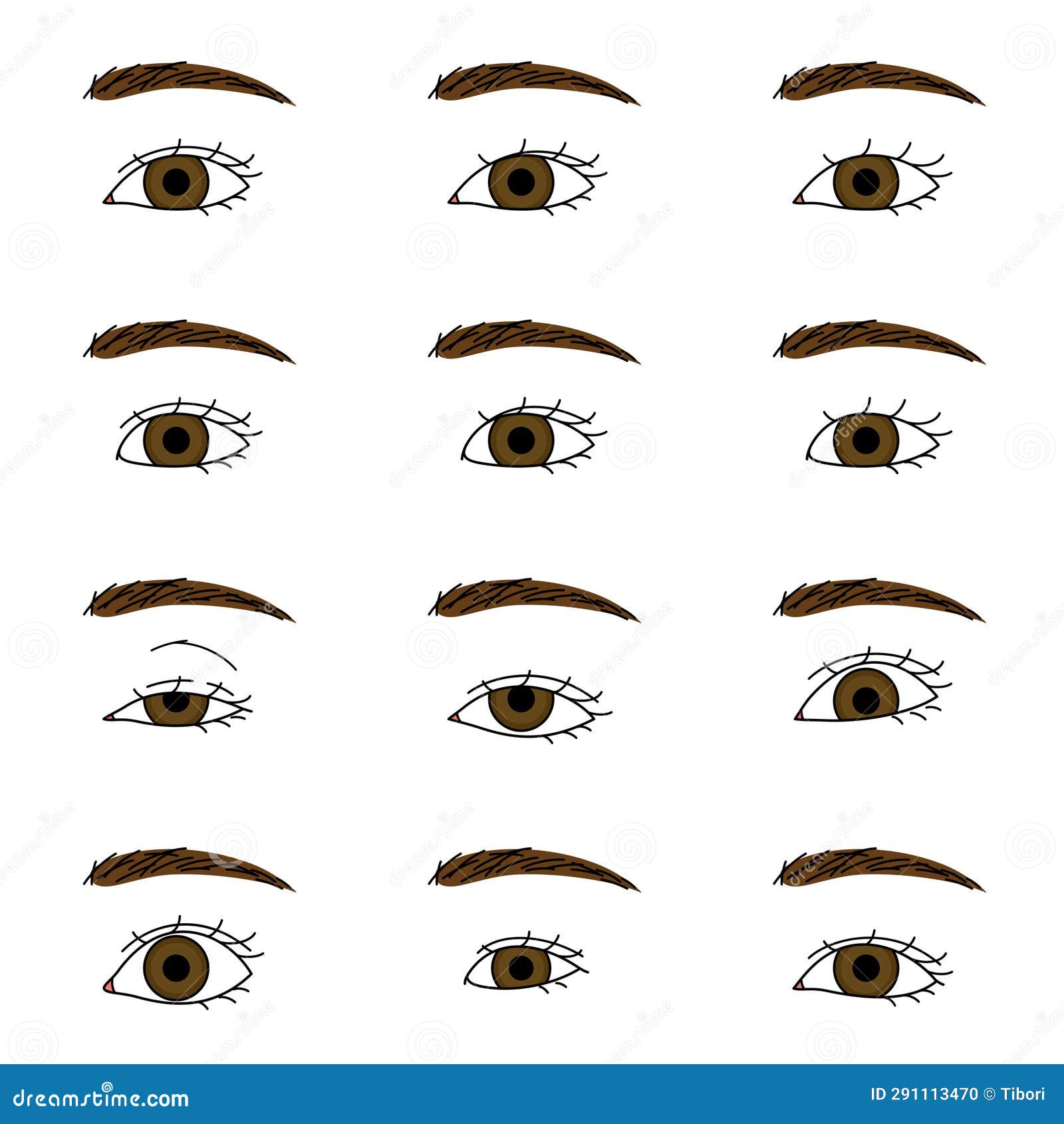 Droopy Eyelid Ptosis, Blepharoplasty Symptom, Myasthenia Gravis ...