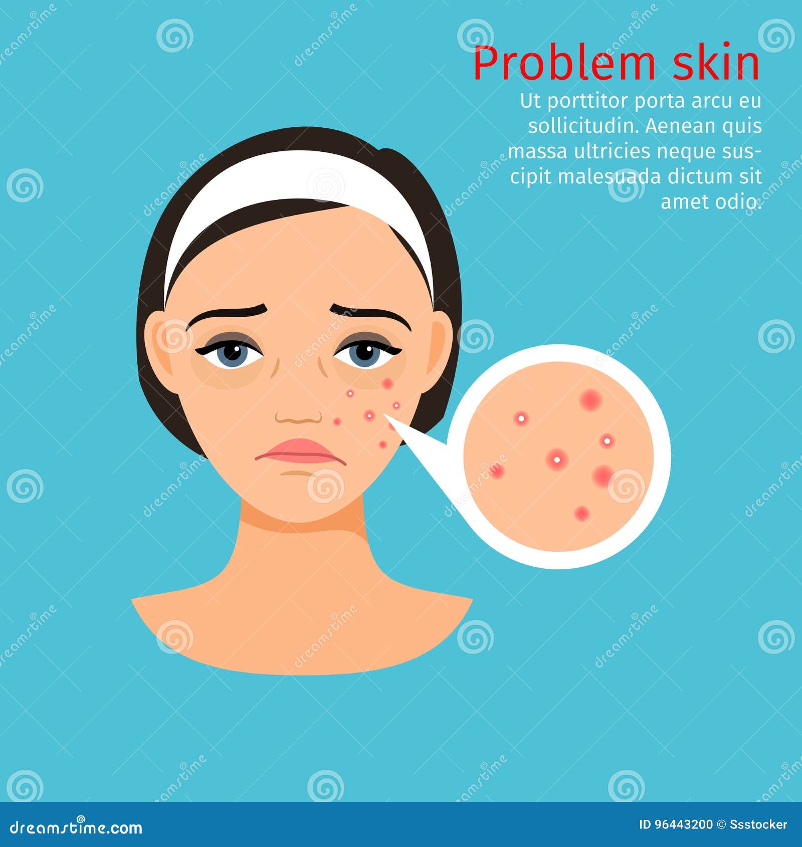 Woman Face Problem Skin With Acne Stock Vector Illustration Of