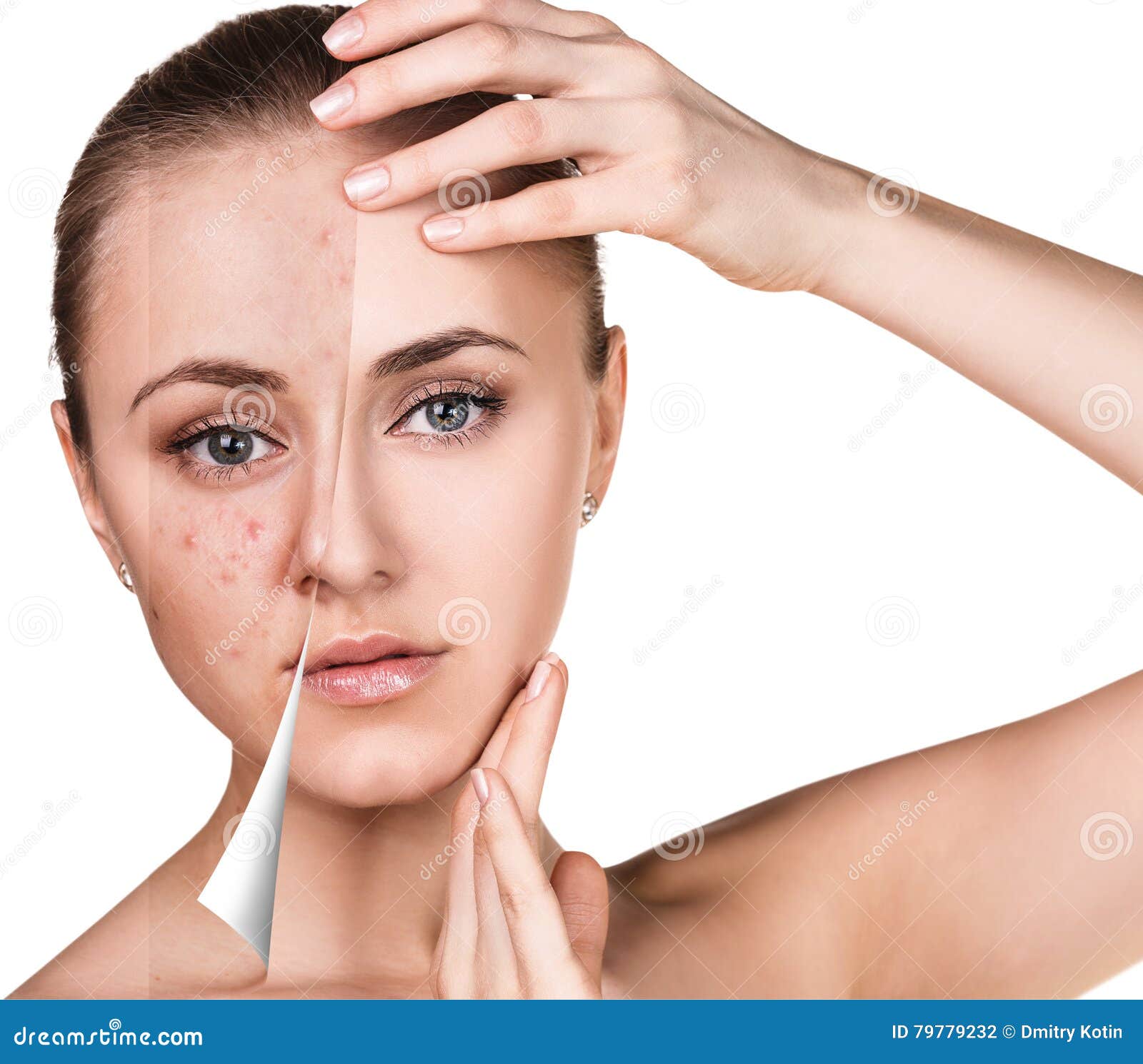 Woman Face before and after Retouch Stock Photo - Image of model ...