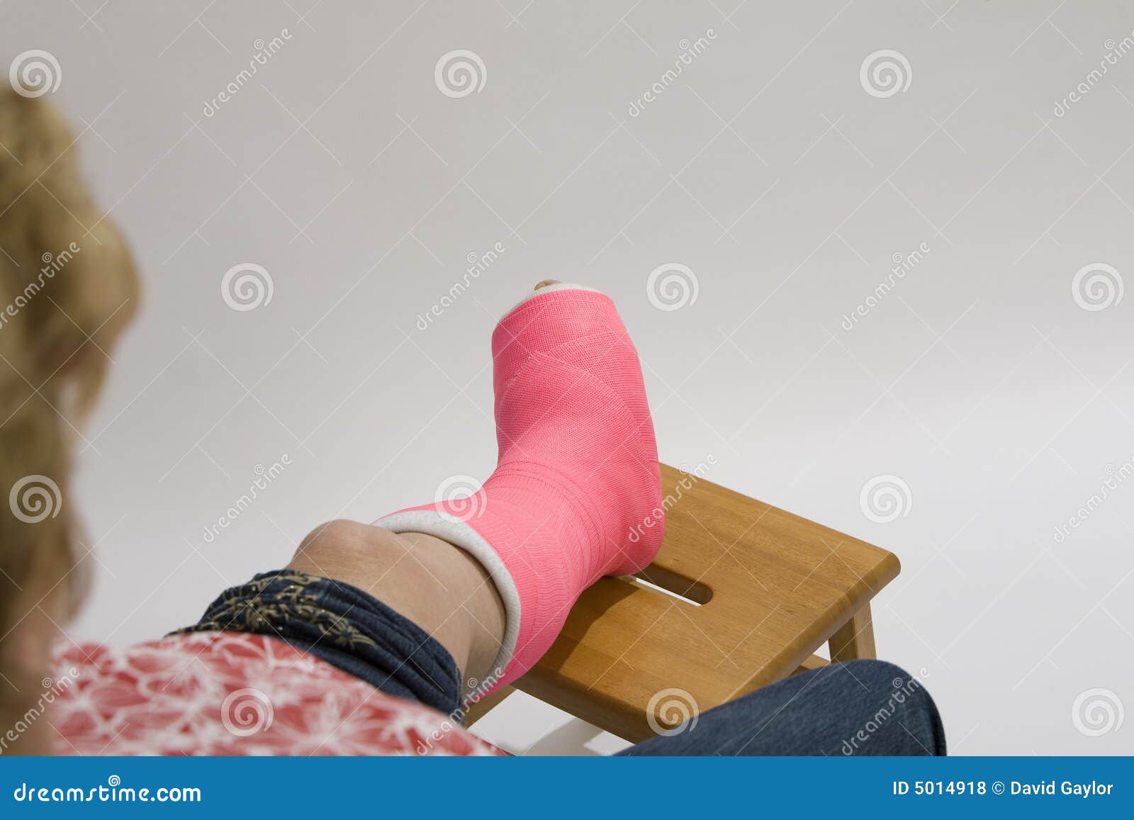 Woman with foot in cast stock photo. Image of pink, pain - 5014918