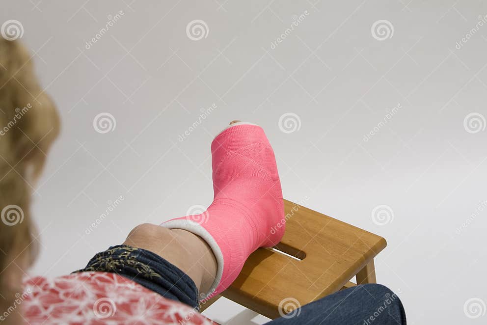 Woman with foot in cast stock photo. Image of pink, pain - 5014918