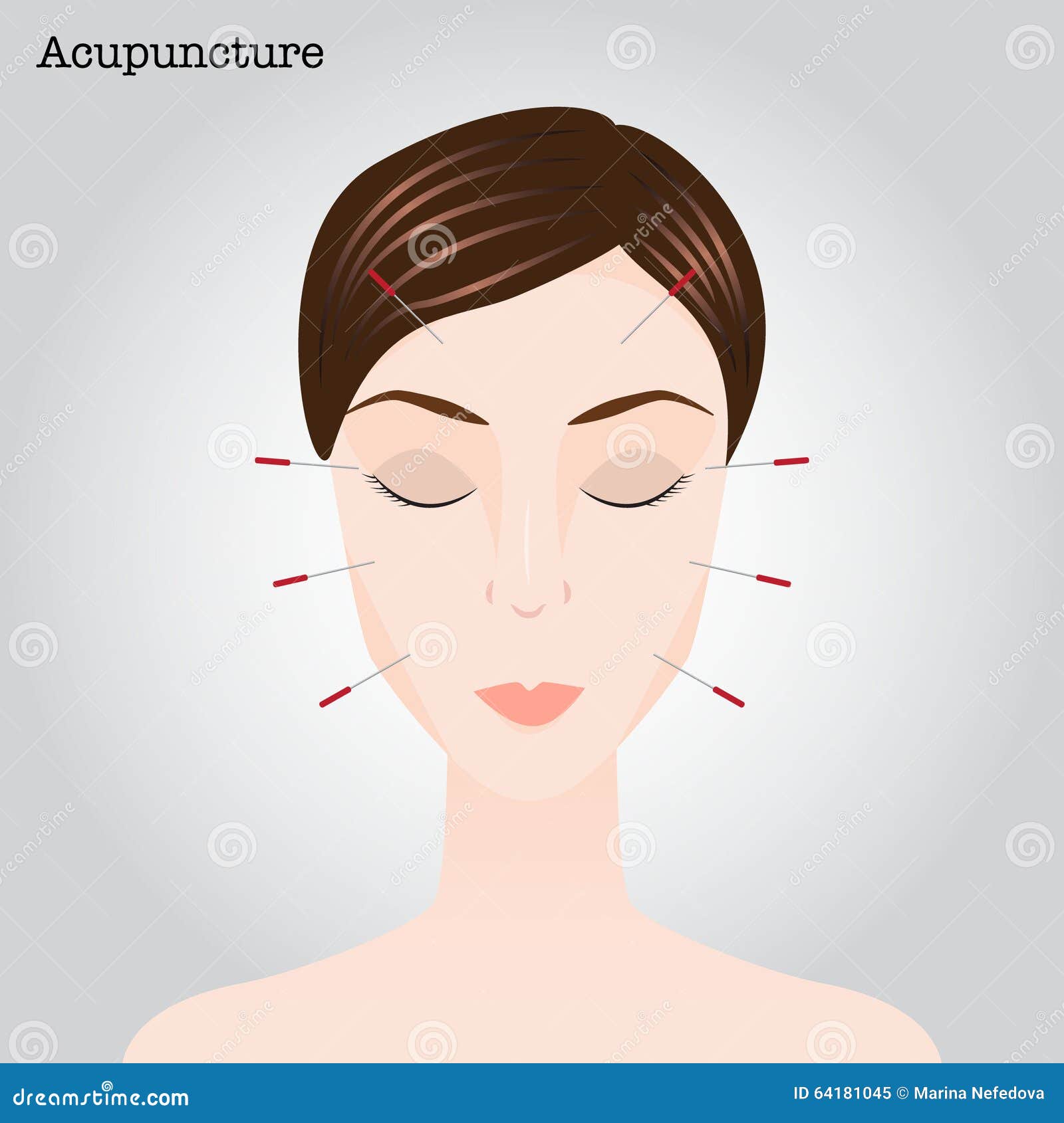 Woman Getting an Acupuncture Treatment Stock Illustration ...