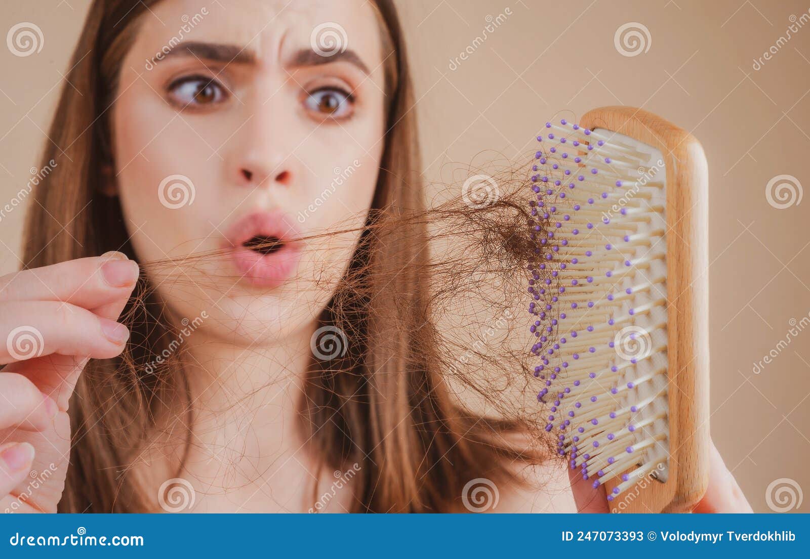 Woman with Hair Loss Problem Worried about Hair Loss. Stock Image ...