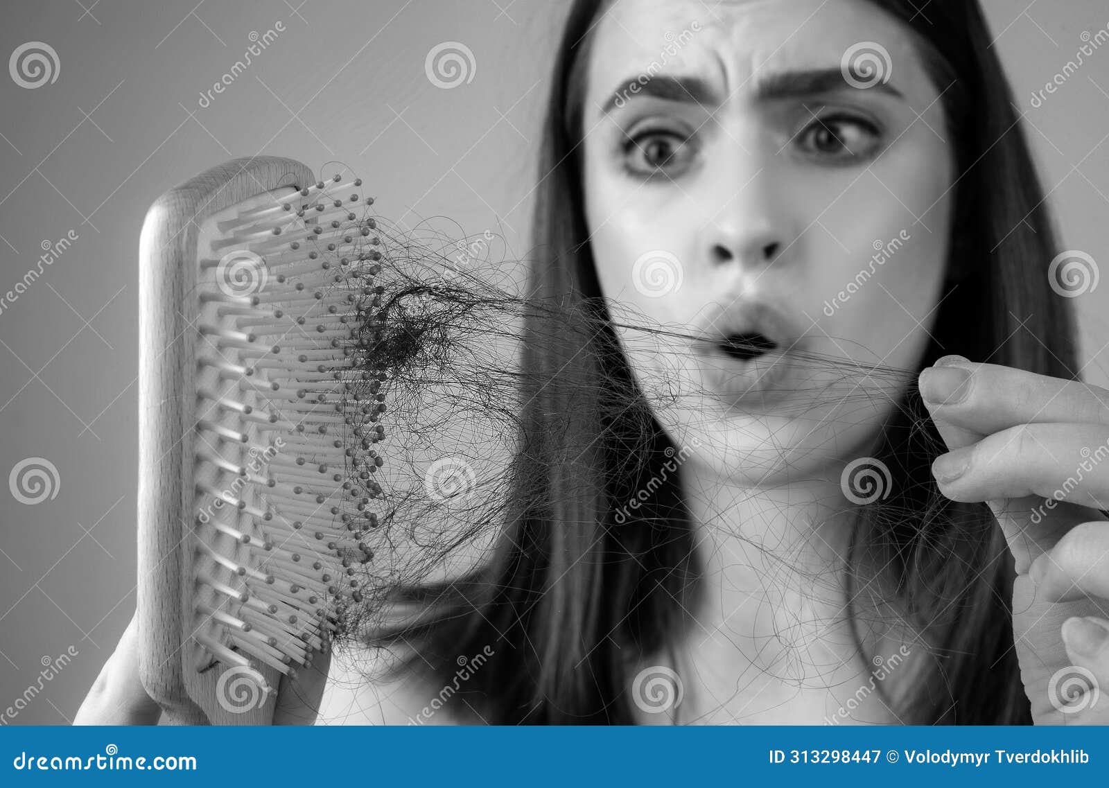Woman with Hair Loss Problem Worried about Hair Loss. Stock Image ...