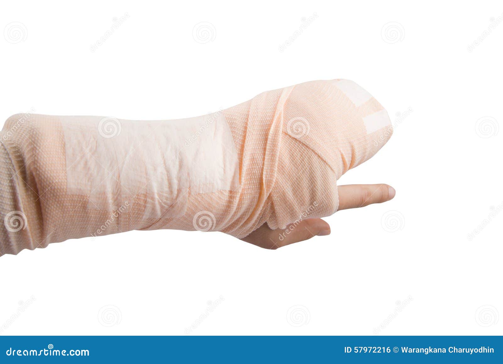 Woman Hand Bone Broken from Accident Emergency Isolate Stock Photo ...