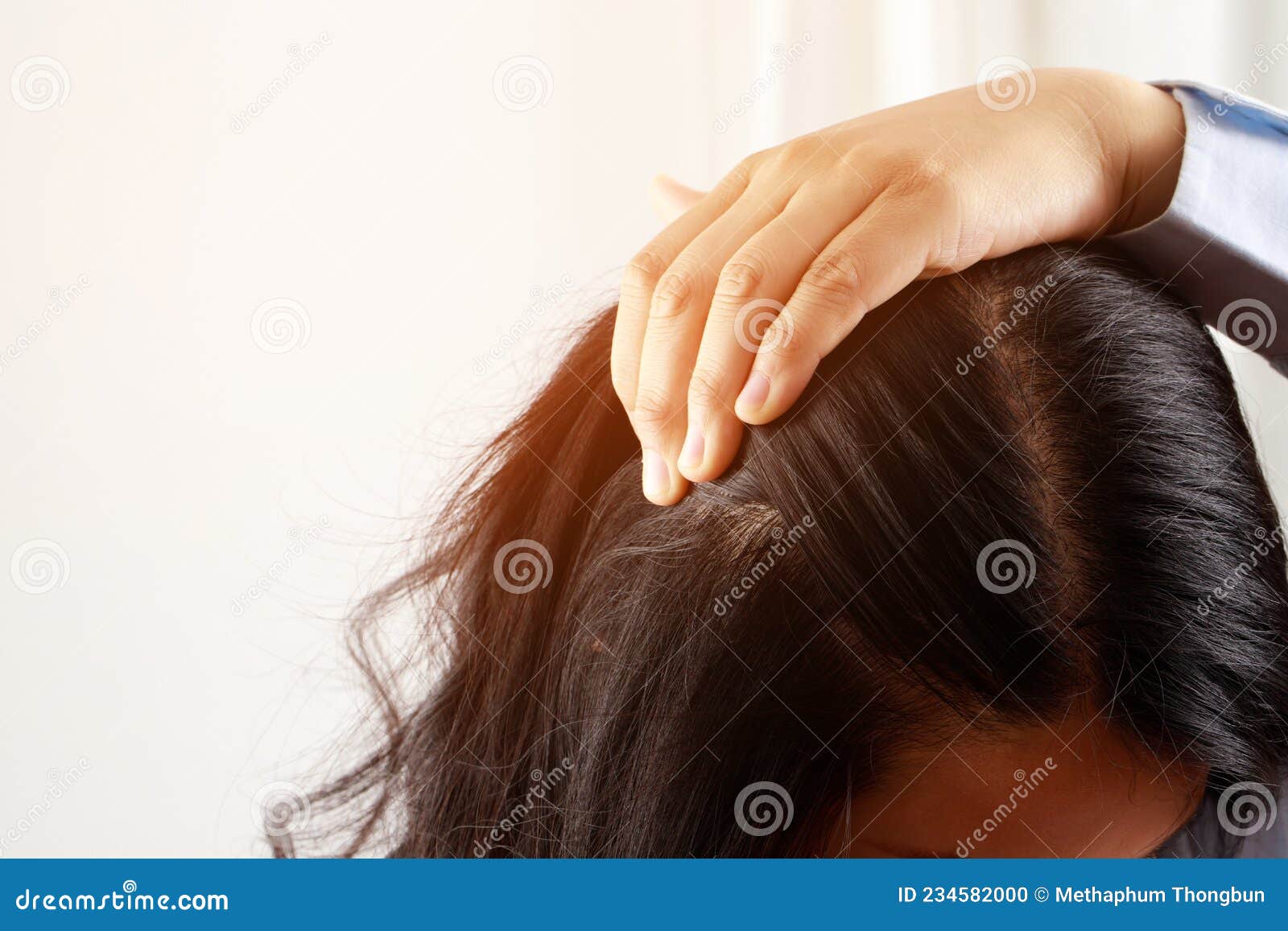 A Woman Has Problems with Hair and Scalp Stock Photo - Image of adult ...