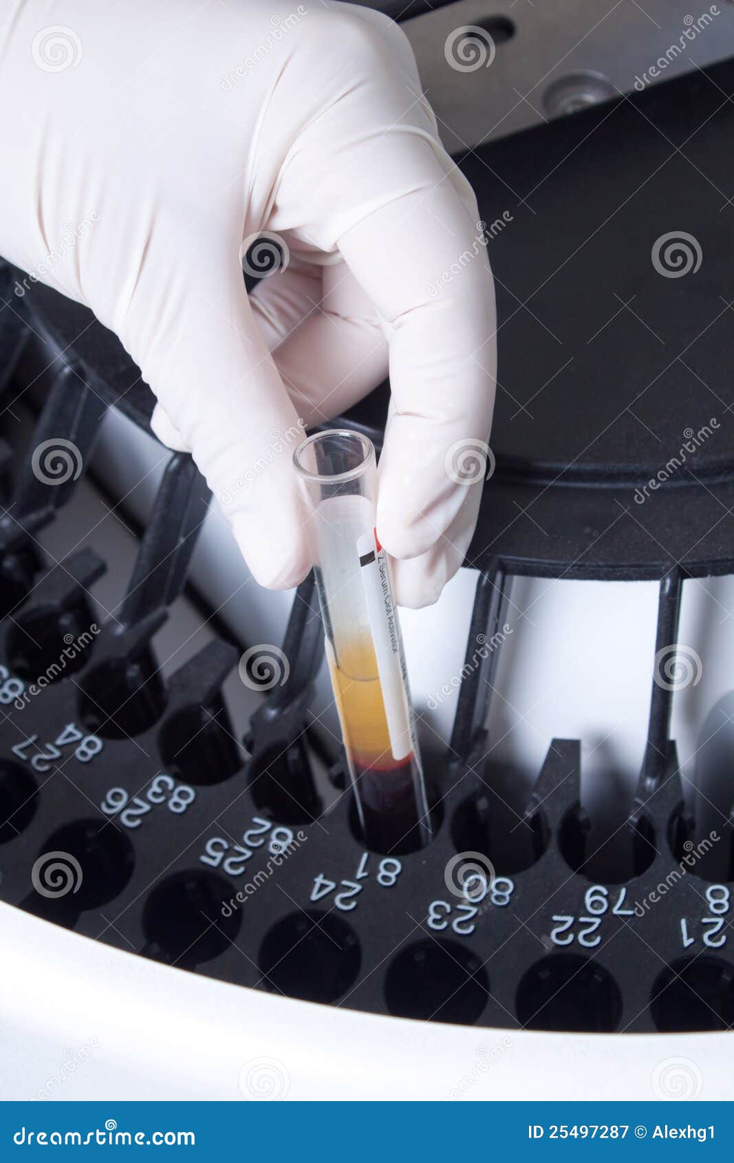 Woman Loading Samples in Analyzer Stock Image - Image of analysis ...
