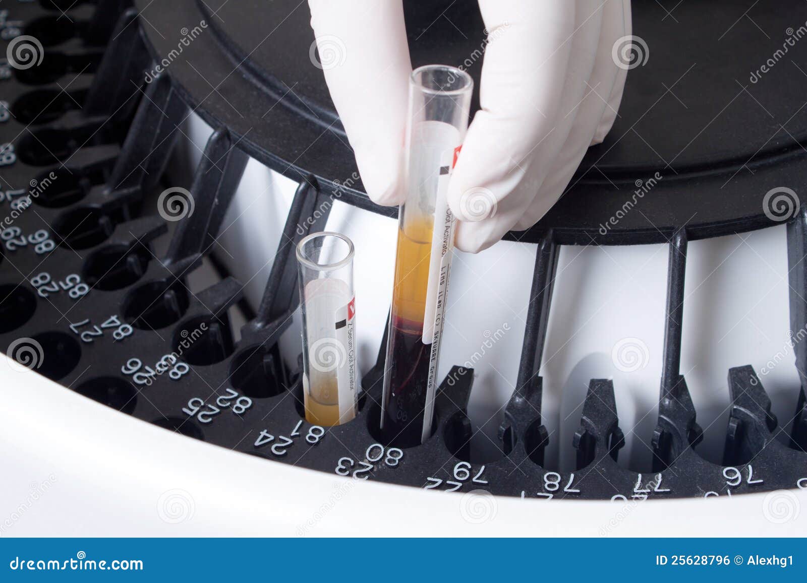 Woman Loading Samples in Analyzer Stock Photo - Image of health ...
