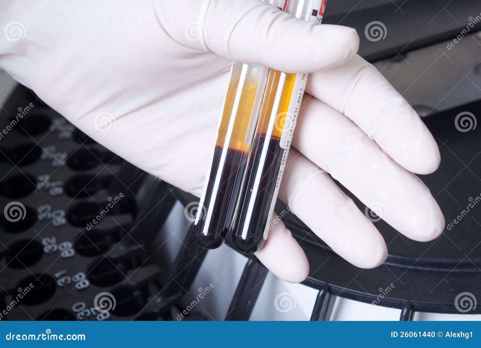 Woman Loading Samples in Analyzer Stock Photo - Image of equipment ...