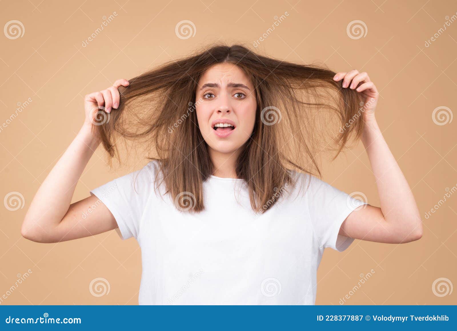 Woman Loosing Hair. Hair Loss Problem, Baldness. Stock Image - Image of ...