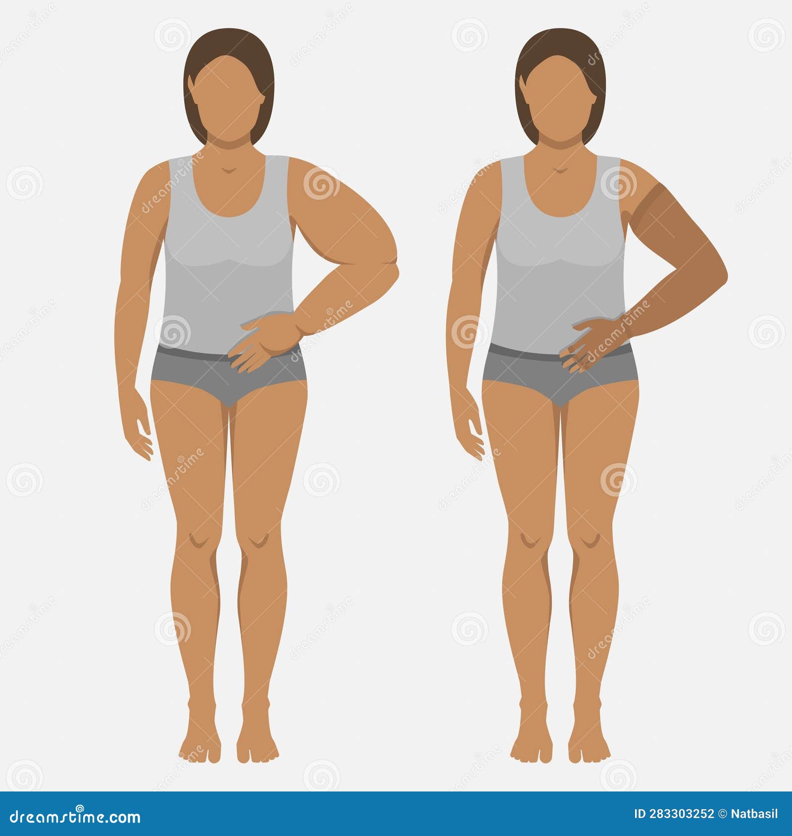 Woman with Lymphedema in Compression Arm Sleeve Stock Vector ...