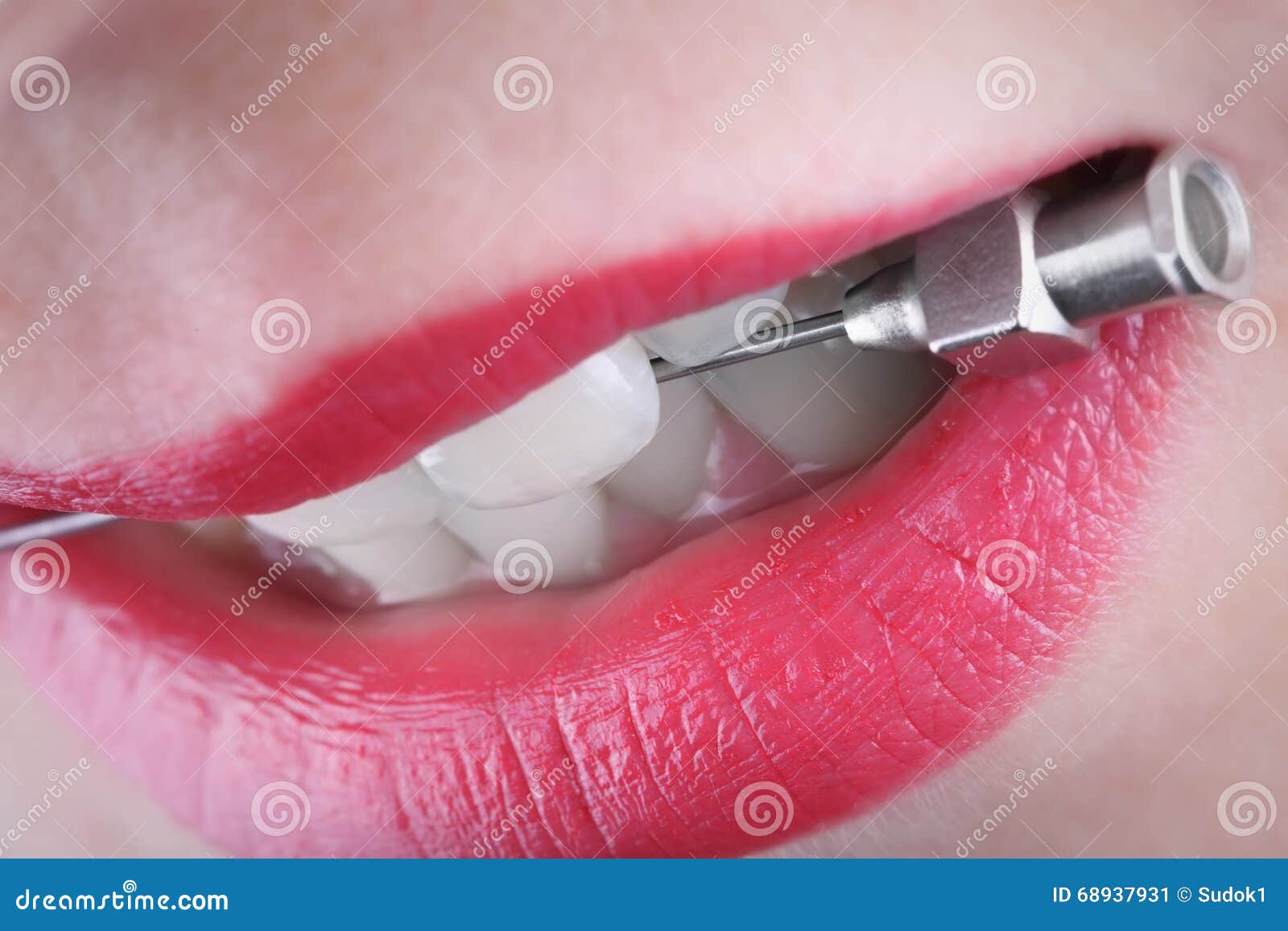 Woman with Medical Needle in the Mouth Stock Image - Image of macro ...