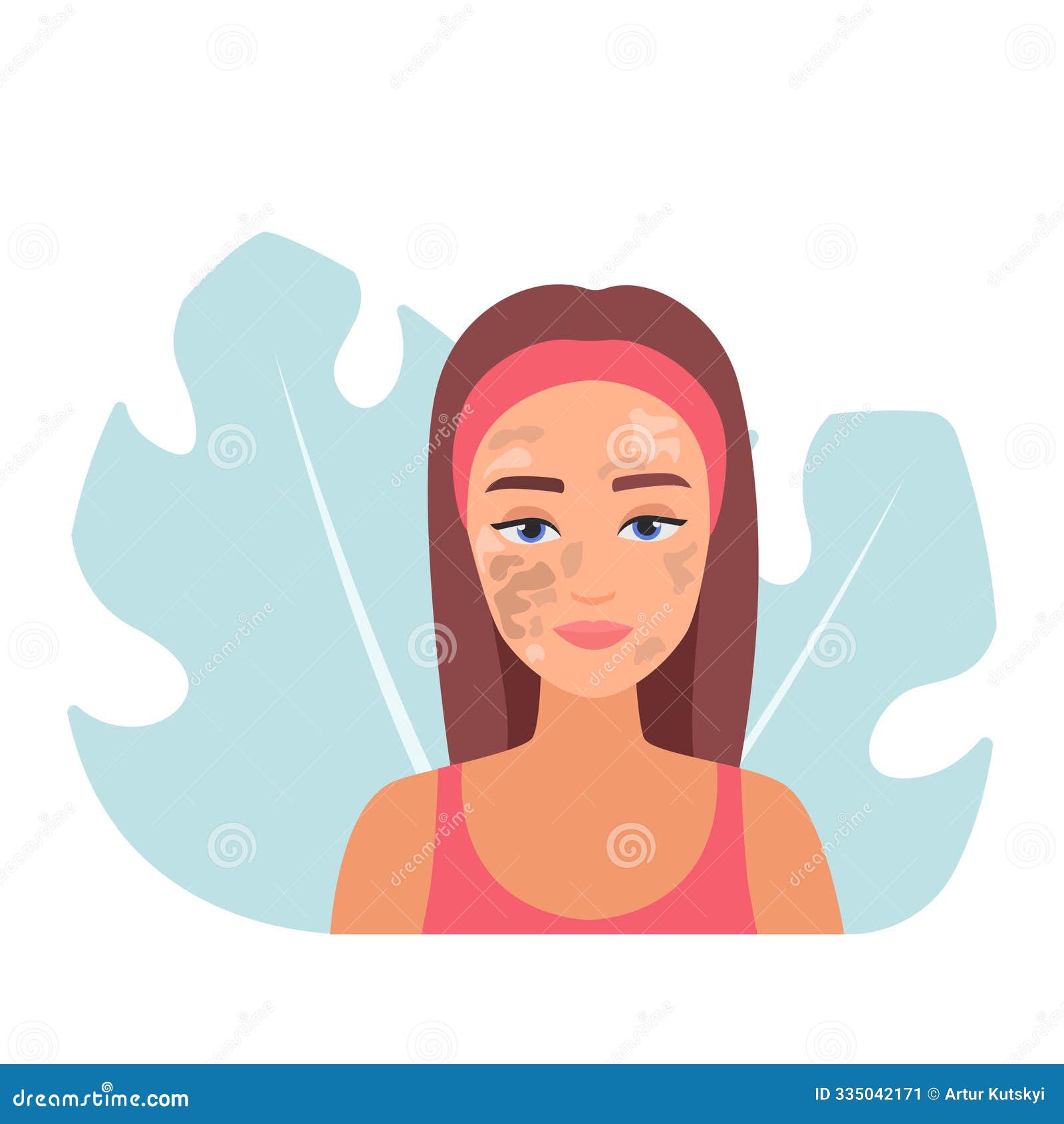 Woman With Melasma On Her Face. Illustration Of Person With Dark Spots ...