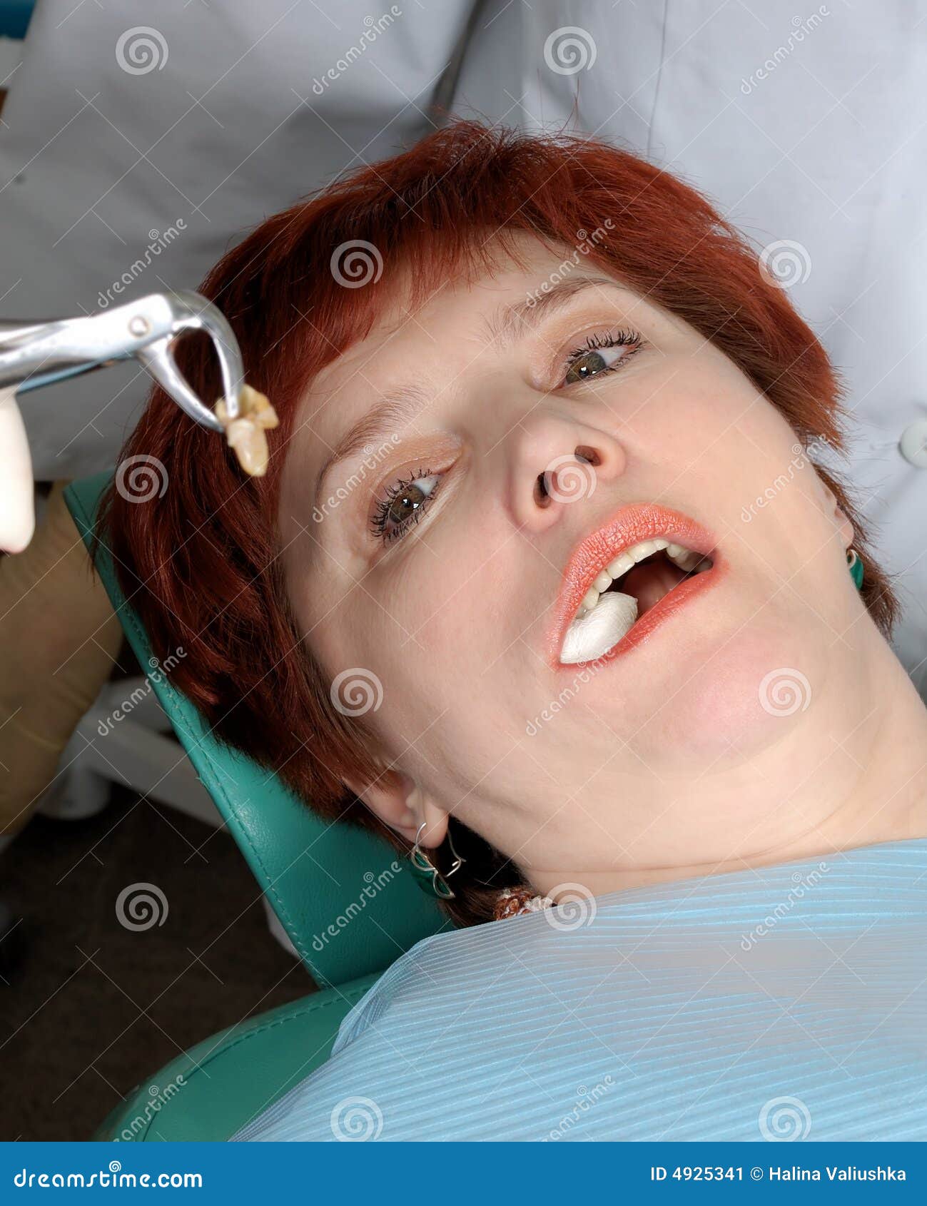 Woman with Open Mouth Look on Her Extract Tooth Stock Image - Image of ...