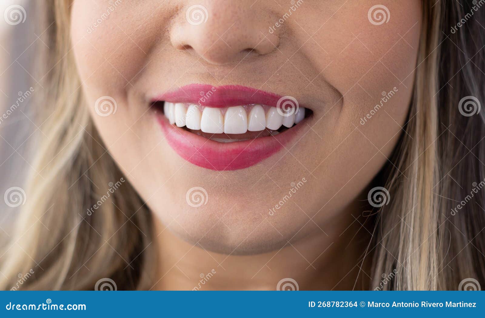Woman with Perfect Smile Design Stock Photo - Image of hospital ...