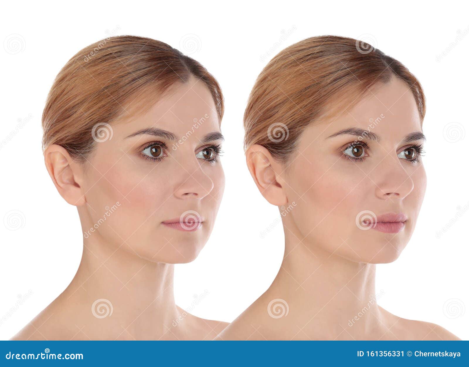 Woman before and after Plastic Surgery on Background Stock Image ...