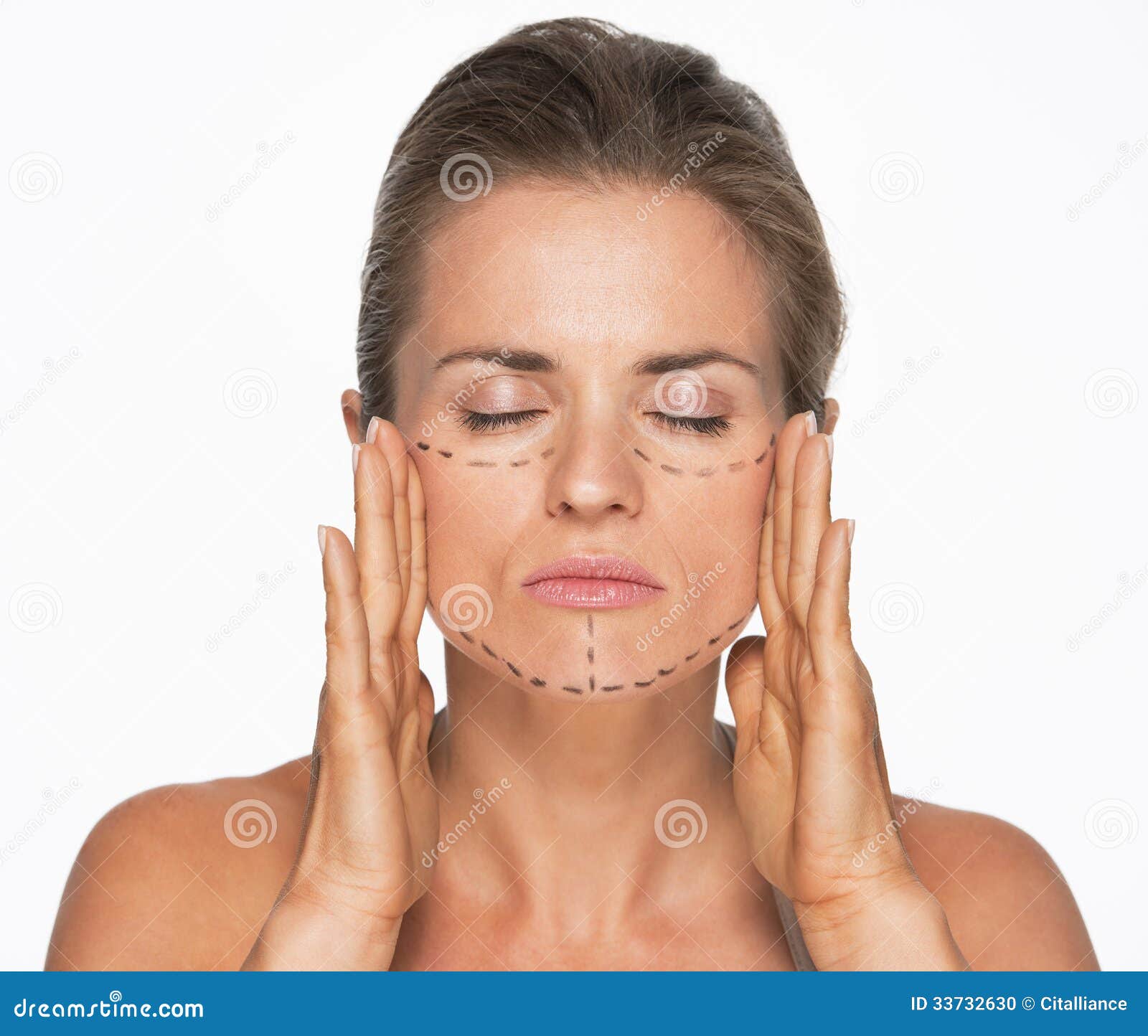 Woman With Marks From Sliding Cupping Therapy Stock Photography ...