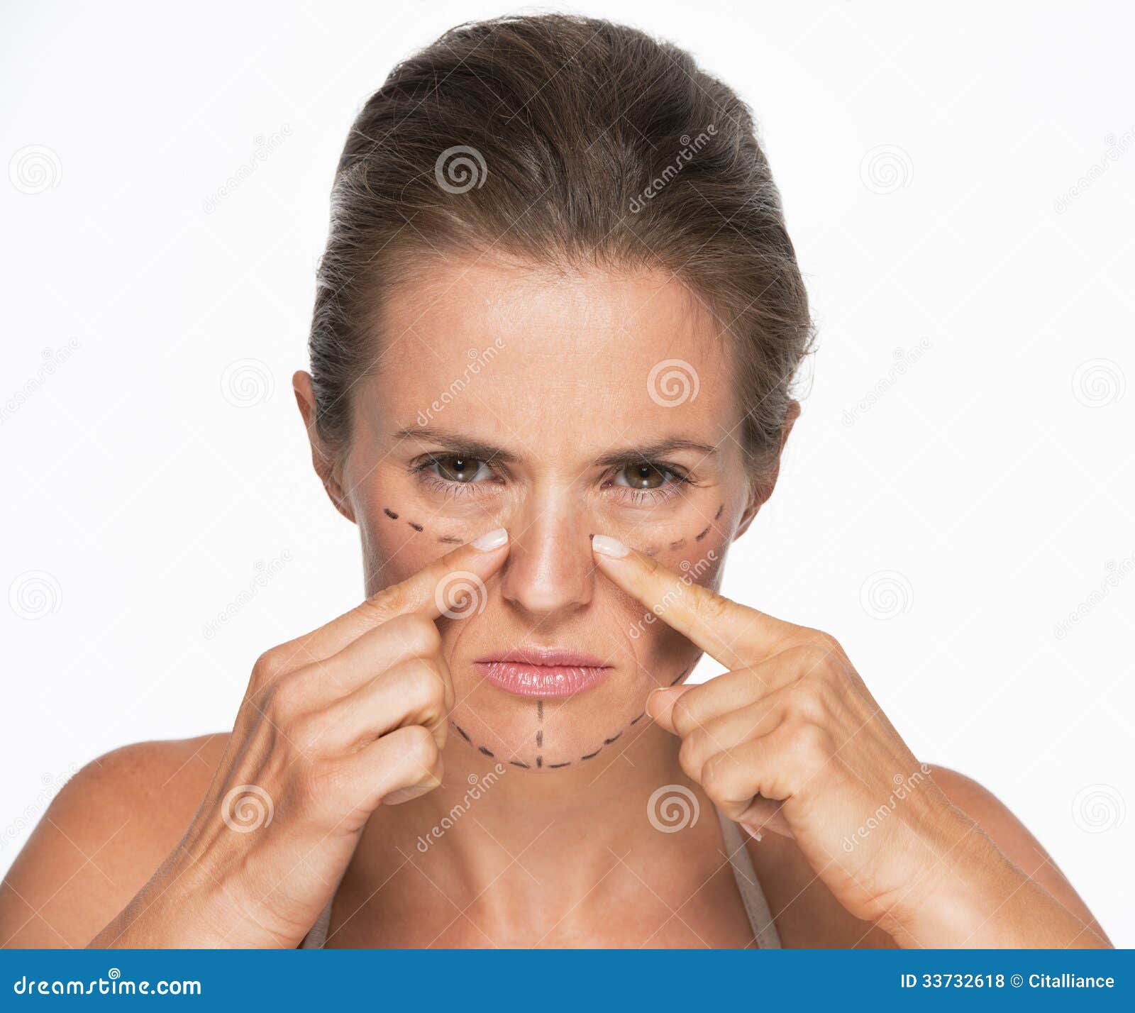 Woman with Plastic Surgery Marks on Face Pointing on Nose Stock Photo ...