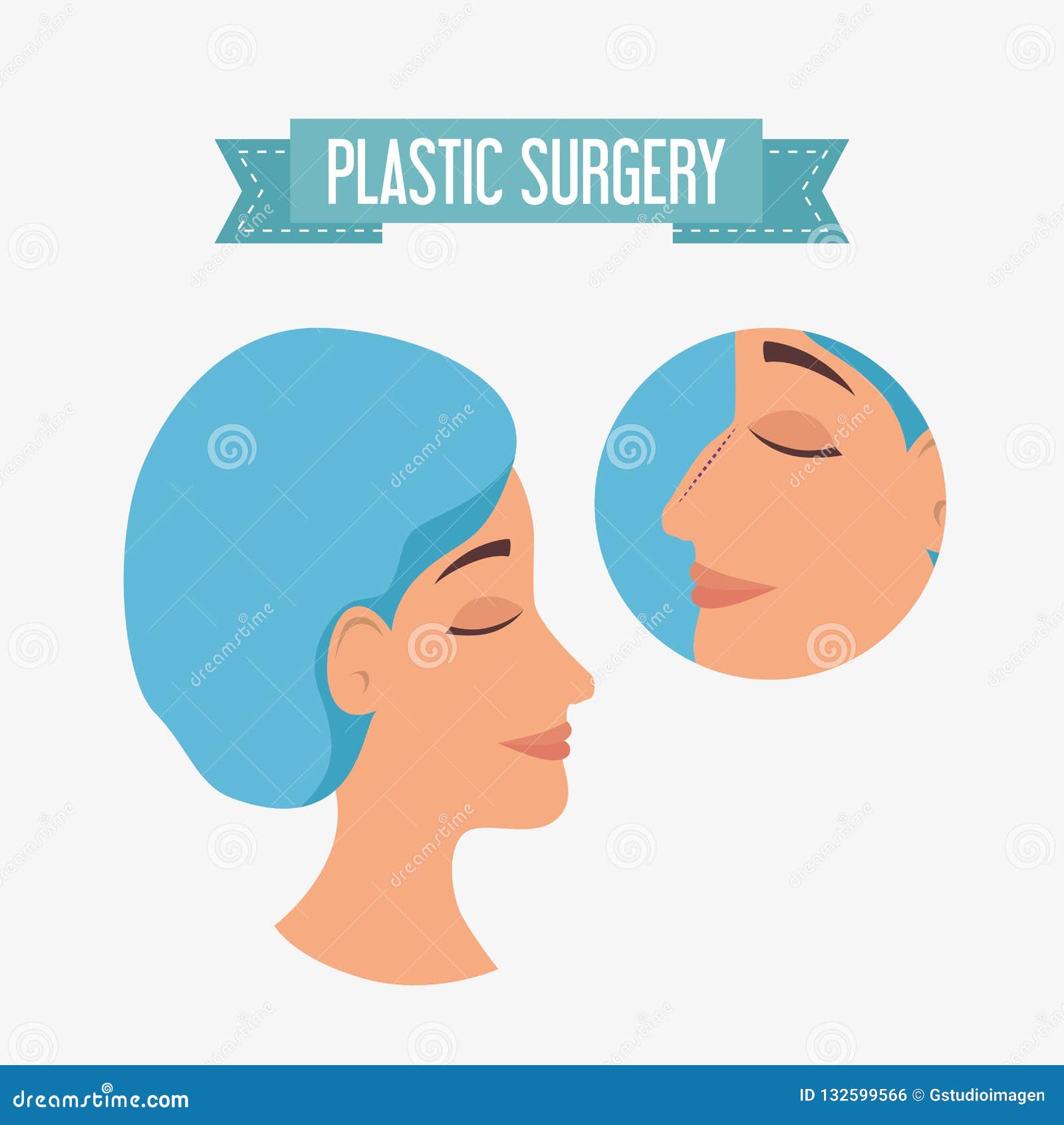 Woman Plastic Surgery Process Stock Vector - Illustration of anatomy ...