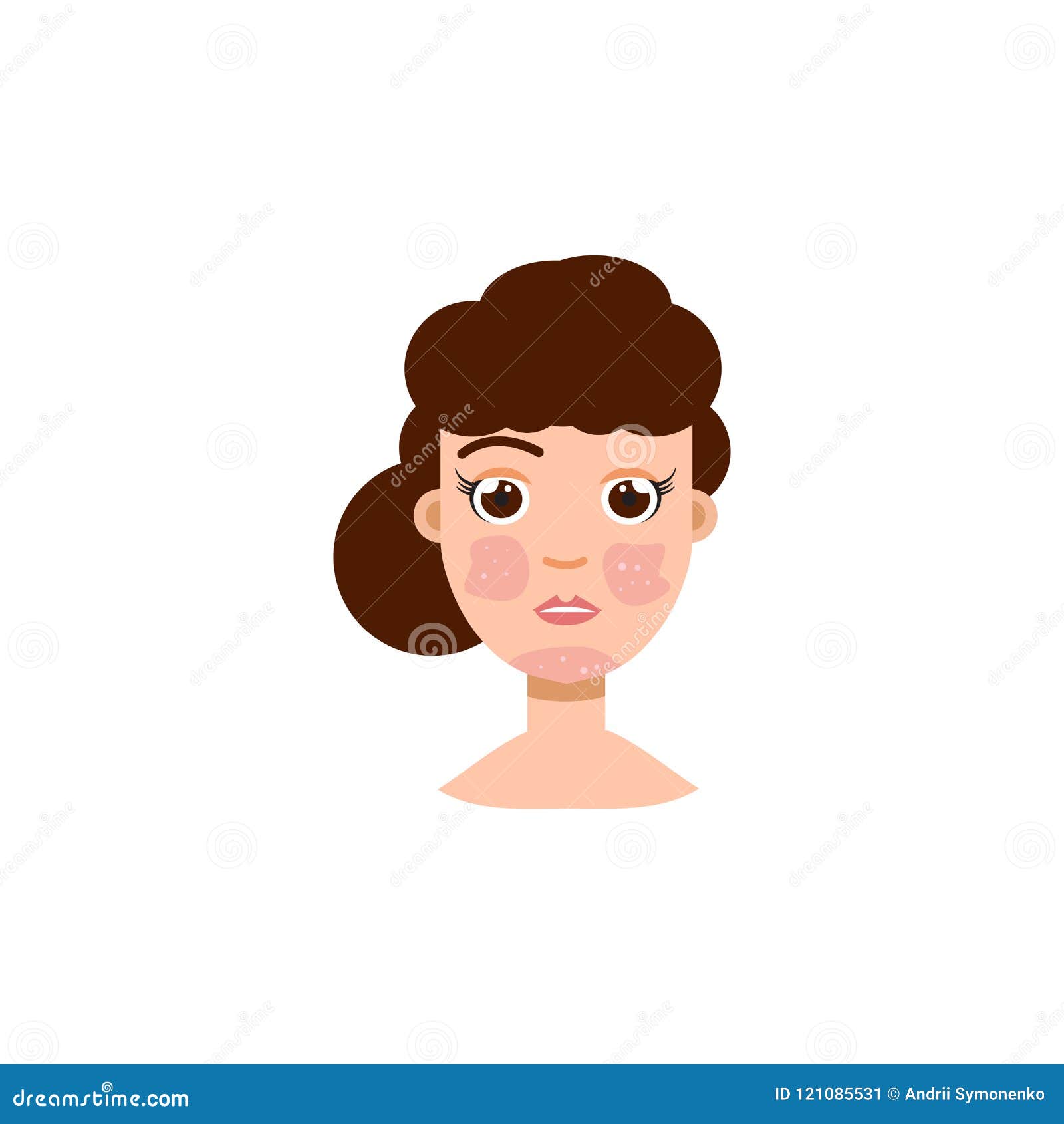 Systemic Lupus Erythematosus Cartoon Vector | CartoonDealer.com #63093251
