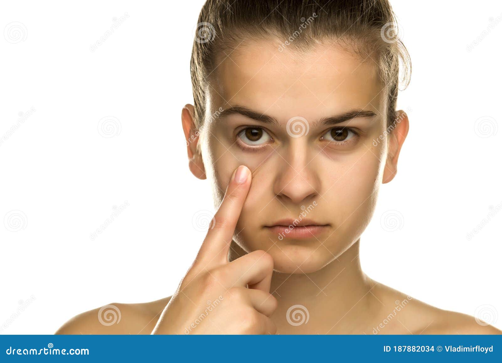 Red Lower Eyelid, A Macro Photo Of The Human Eye. Conjunctivitis ...