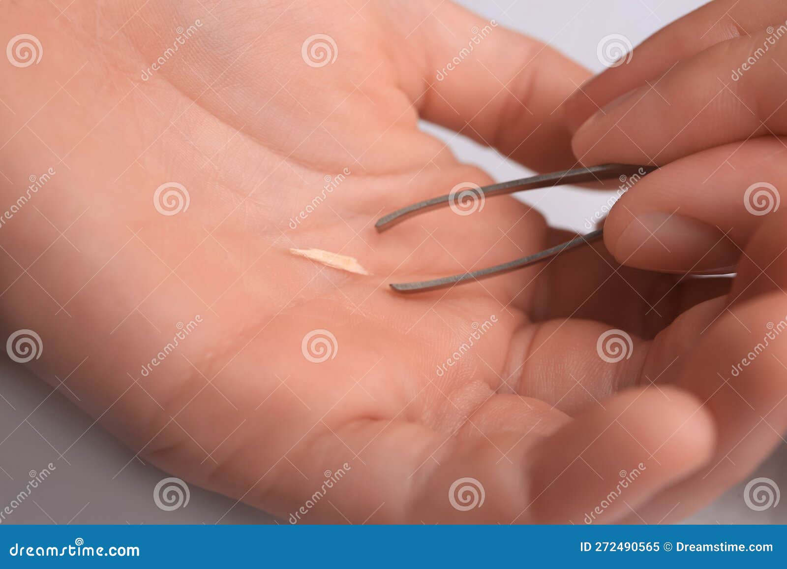 Tweezers Pulling Tooth From The Lower Jaw Model Stock Illustration ...