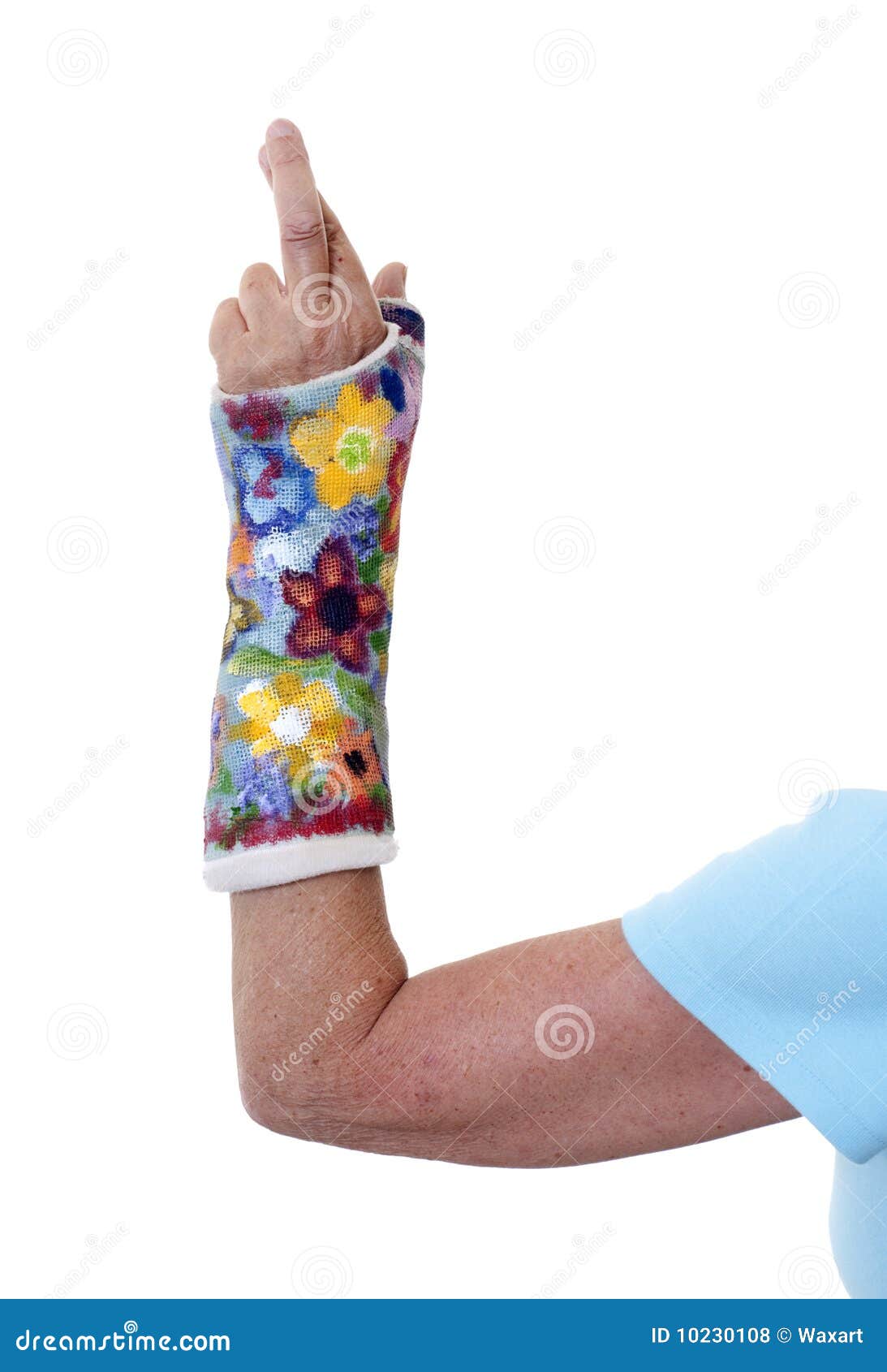 Woman S Arm in Painted Cast Stock Photo - Image of painted, broken ...