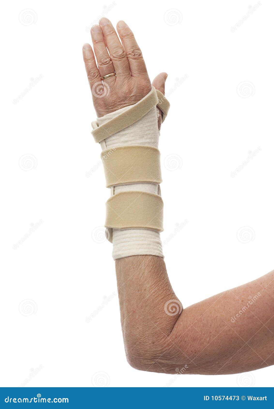 Woman S Bandaged Arm Isolated on White Stock Image - Image of tunnel ...