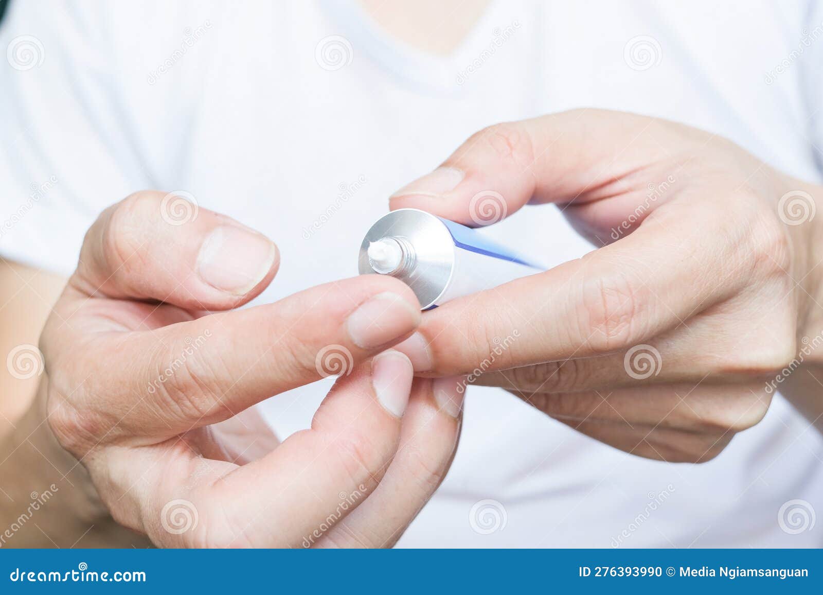 The Woman S Hand, she Uses Steroids Apply External Type Stock Photo ...