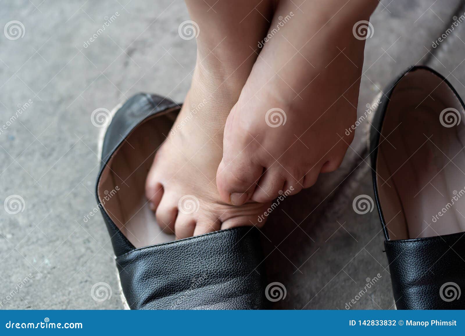 Woman scratch the itch stock photo. Image of medical - 142833832