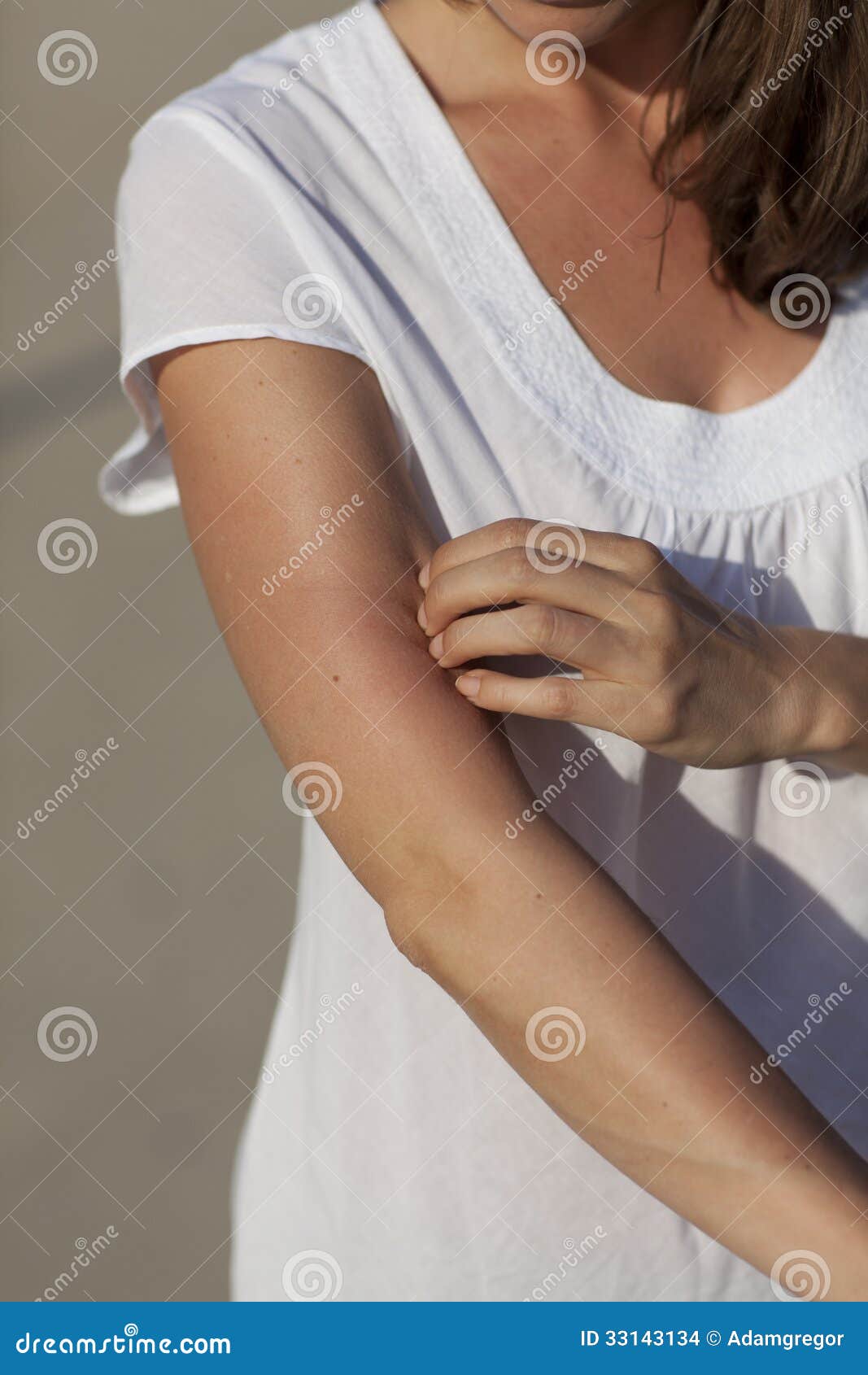 Woman Scratching Her Itchy Back With Allergy Rash Stock Photo ...
