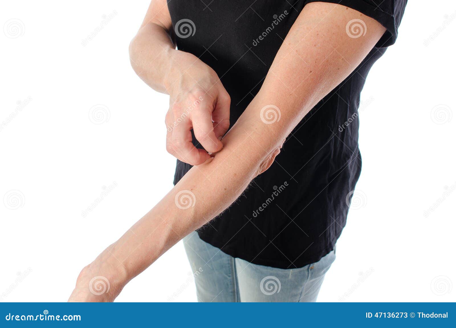 Woman scratching her arm stock image. Image of treatment - 47136273