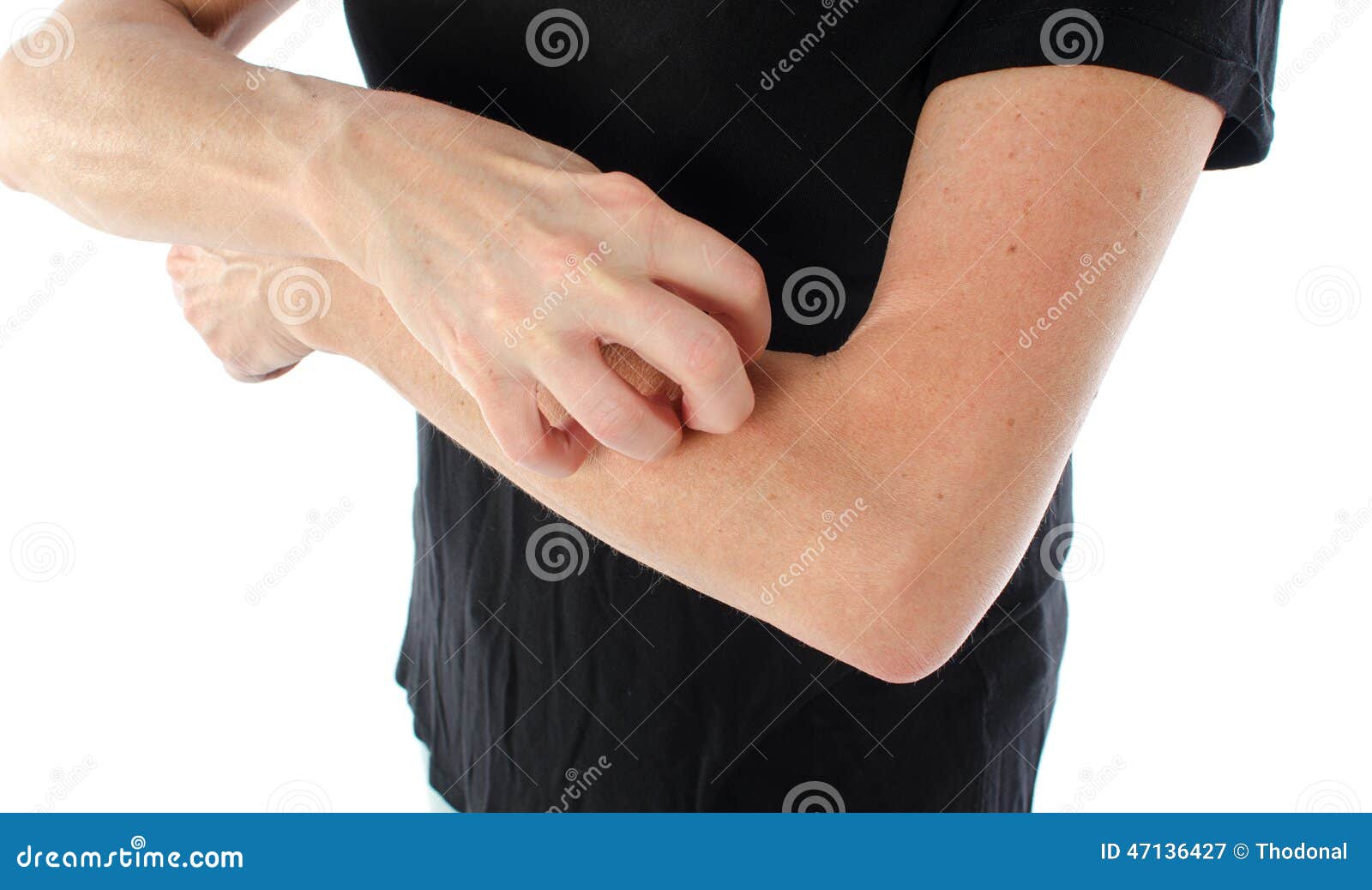 Woman scratching her arm stock image. Image of allergen - 47136427