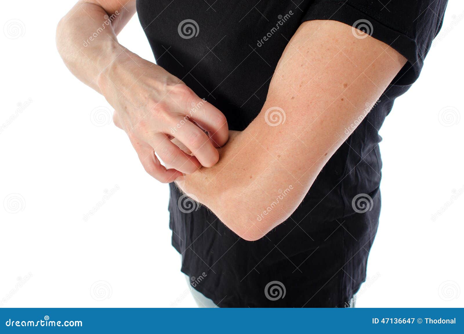 Woman scratching her arm stock image. Image of adult - 47136647