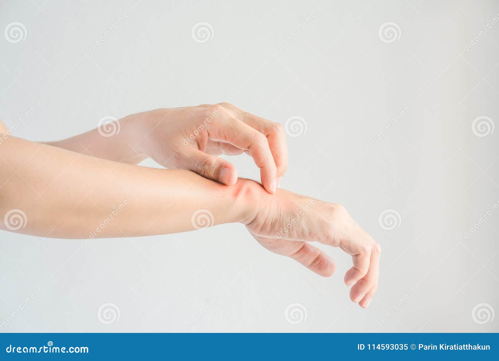 Woman Scratching Her Wrist. Stock Image - Image of disease, human ...